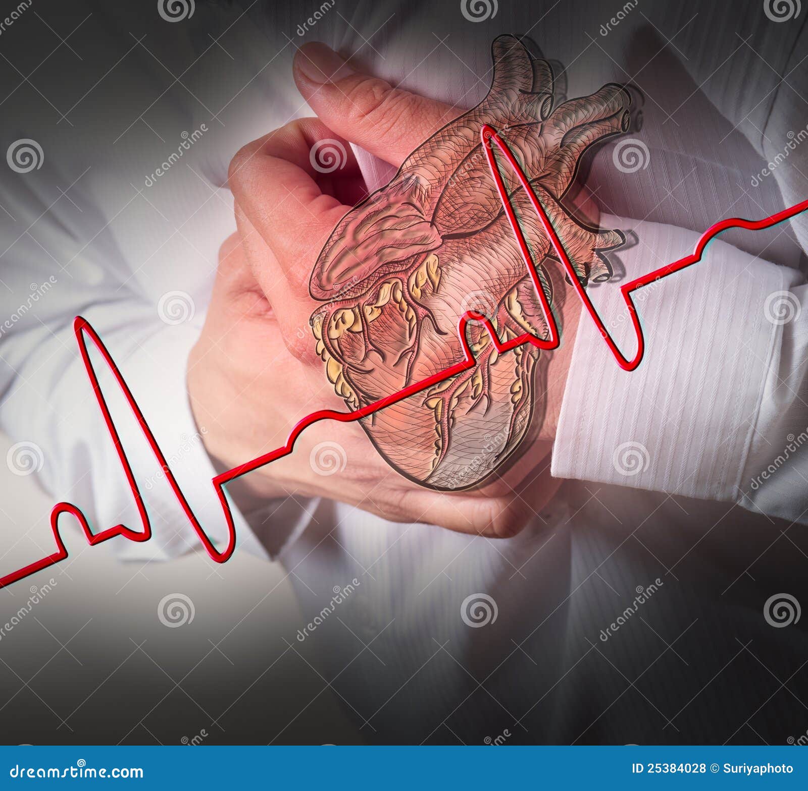 De Hartaanval En Het Hart Slaan Cardiogram Stock Illustratie ...