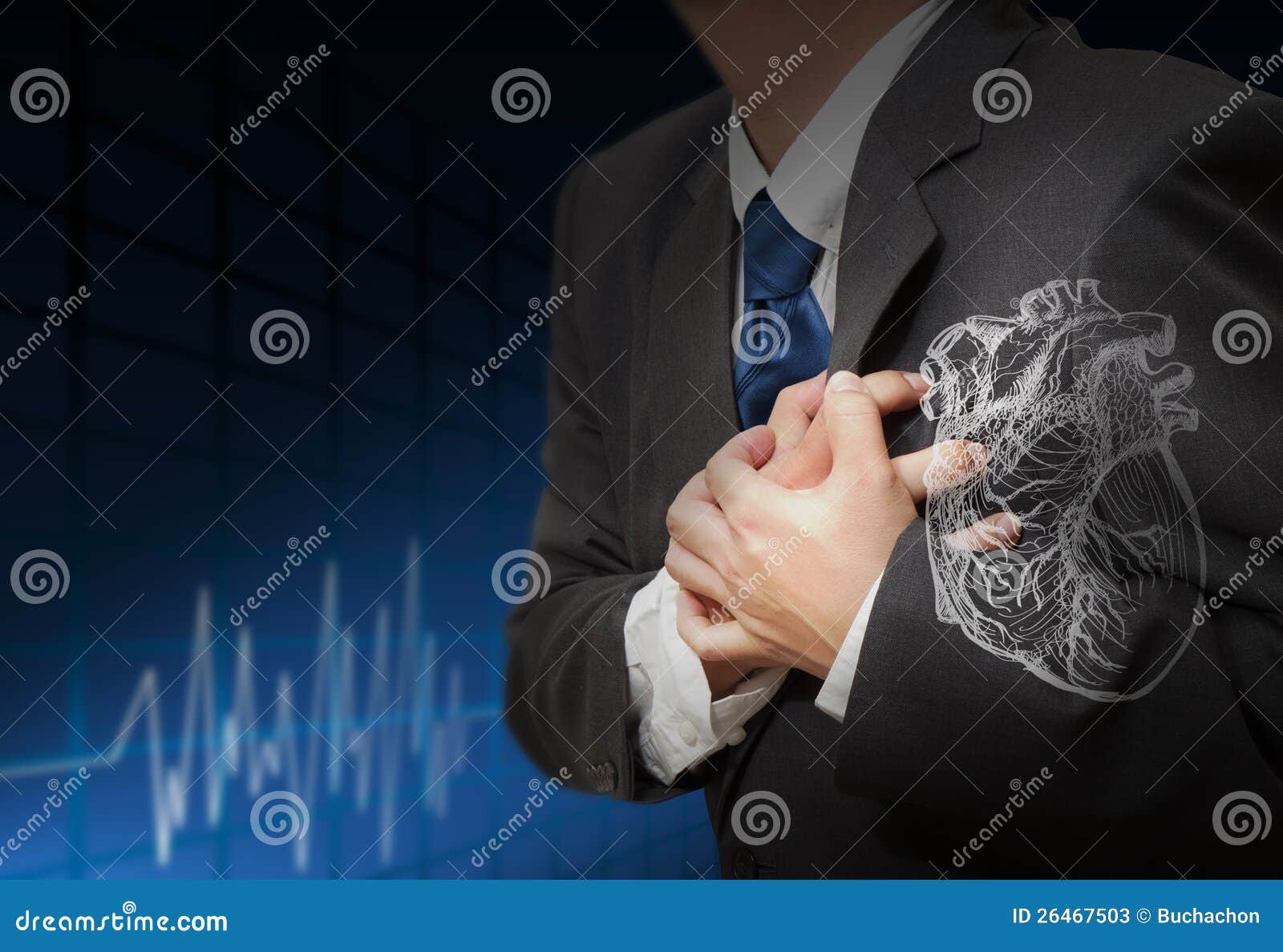 De Hartaanval En Het Hart Slaan Cardiogram Stock Afbeelding - Image of ...