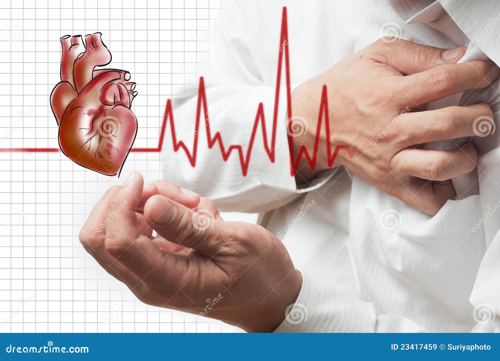 De Hartaanval En Het Hart Slaan Cardiogramachtergrond Stock Afbeelding ...