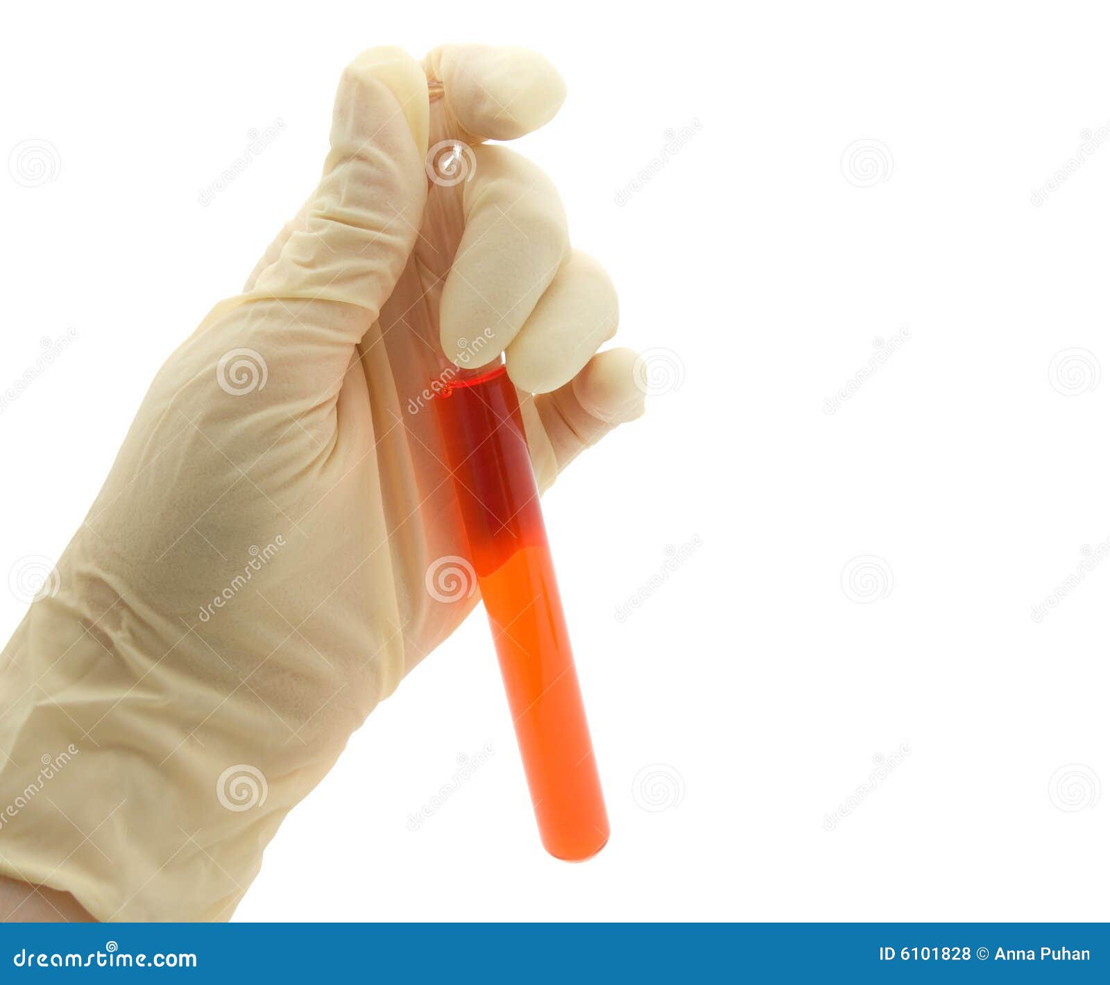 Het Bloed Van De Handholding In Reageerbuis Picture. Image: 6101828