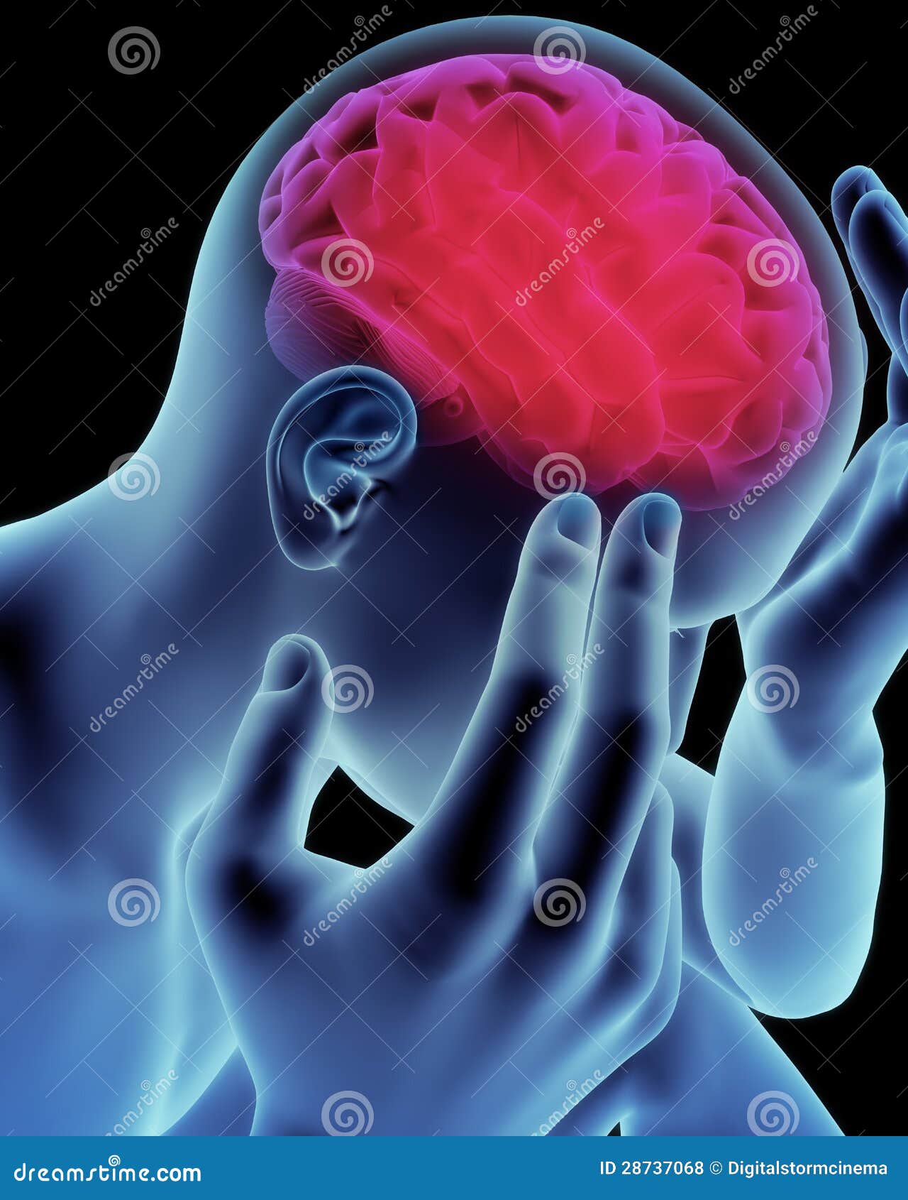 De hoofdpijn van hersenen stock illustratie. Illustration of ...