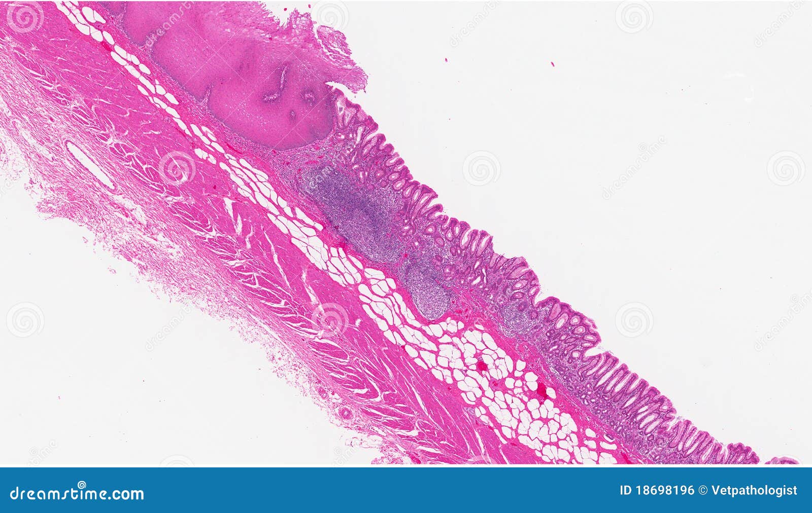 De Maagverbinding Van De Slokdarm Stock Foto - Image of anatomie ...