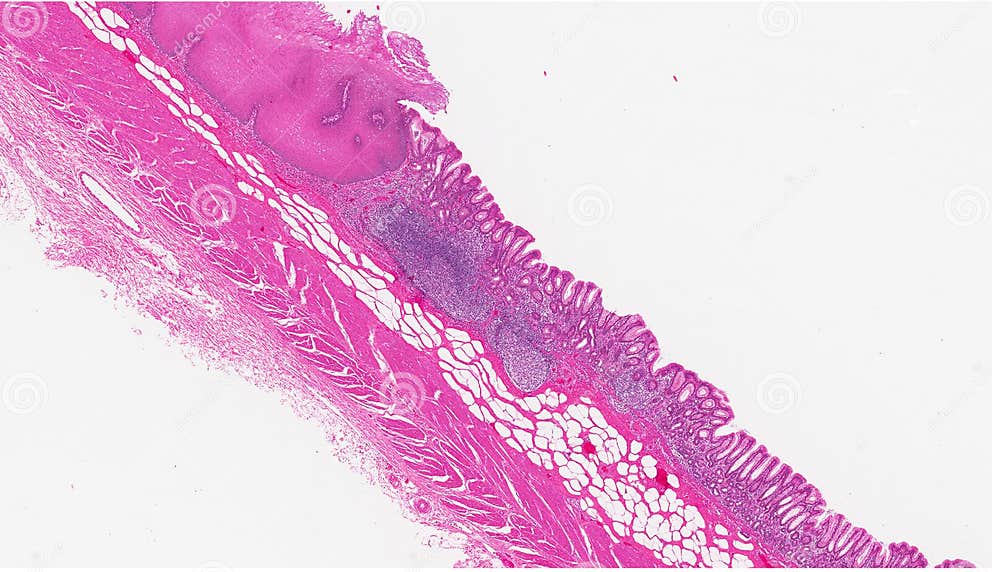 De Maagverbinding Van De Slokdarm Stock Foto - Image of anatomie ...