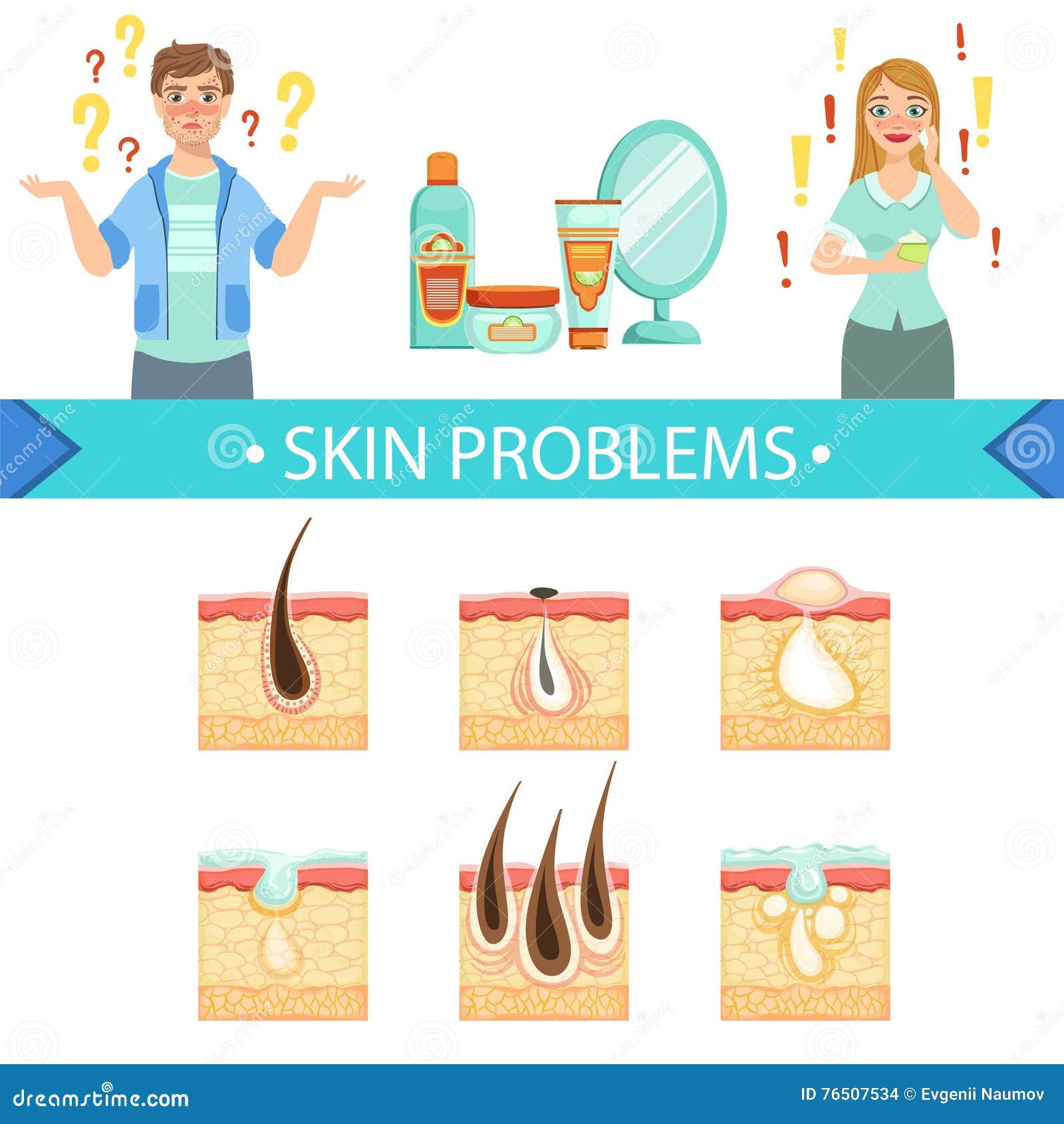 De Medische Affiche Van Infographic Van Huidproblemen Vector ...