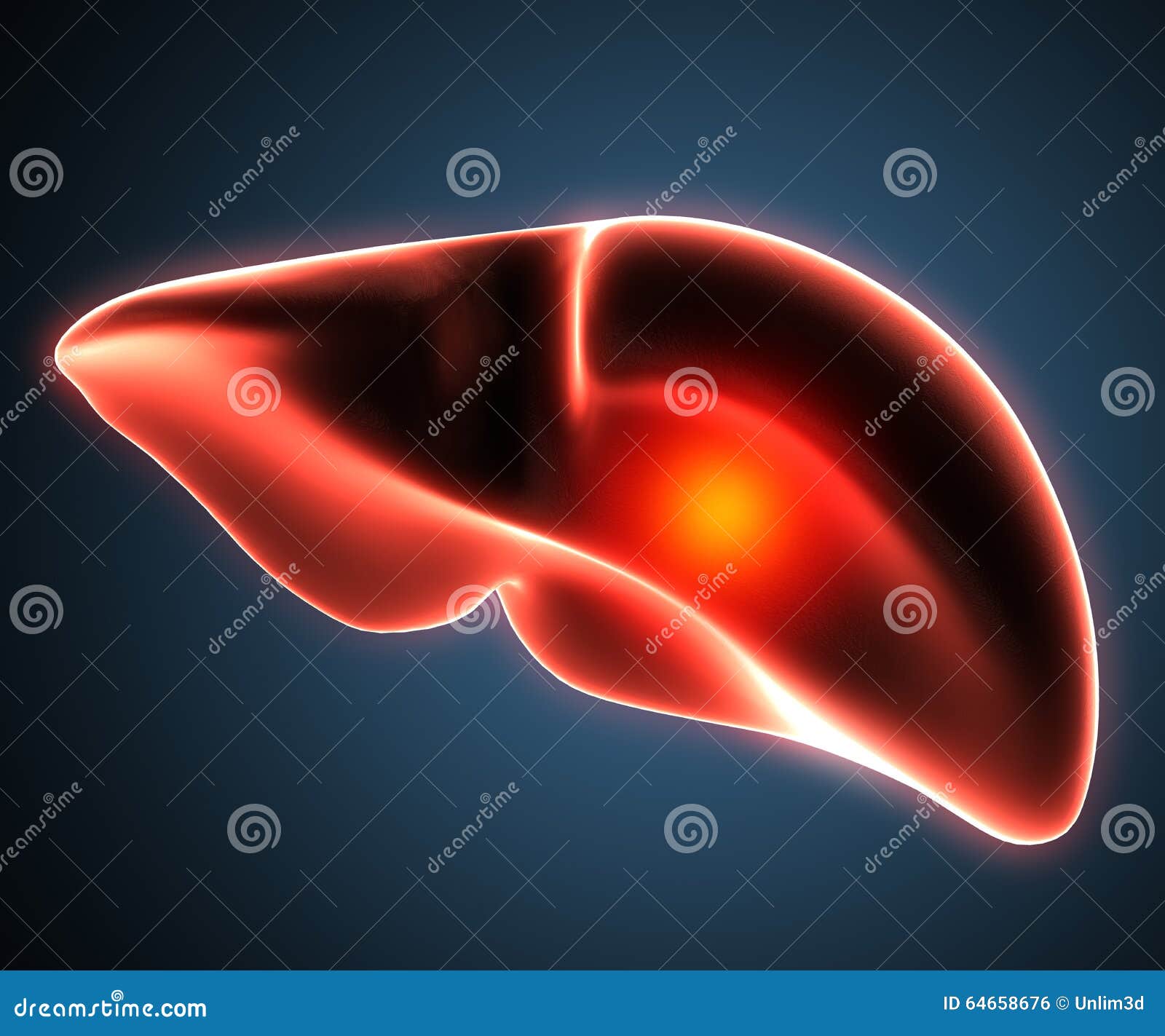 De Menselijke Anatomie Van De Leverziekte Stock Illustratie ...