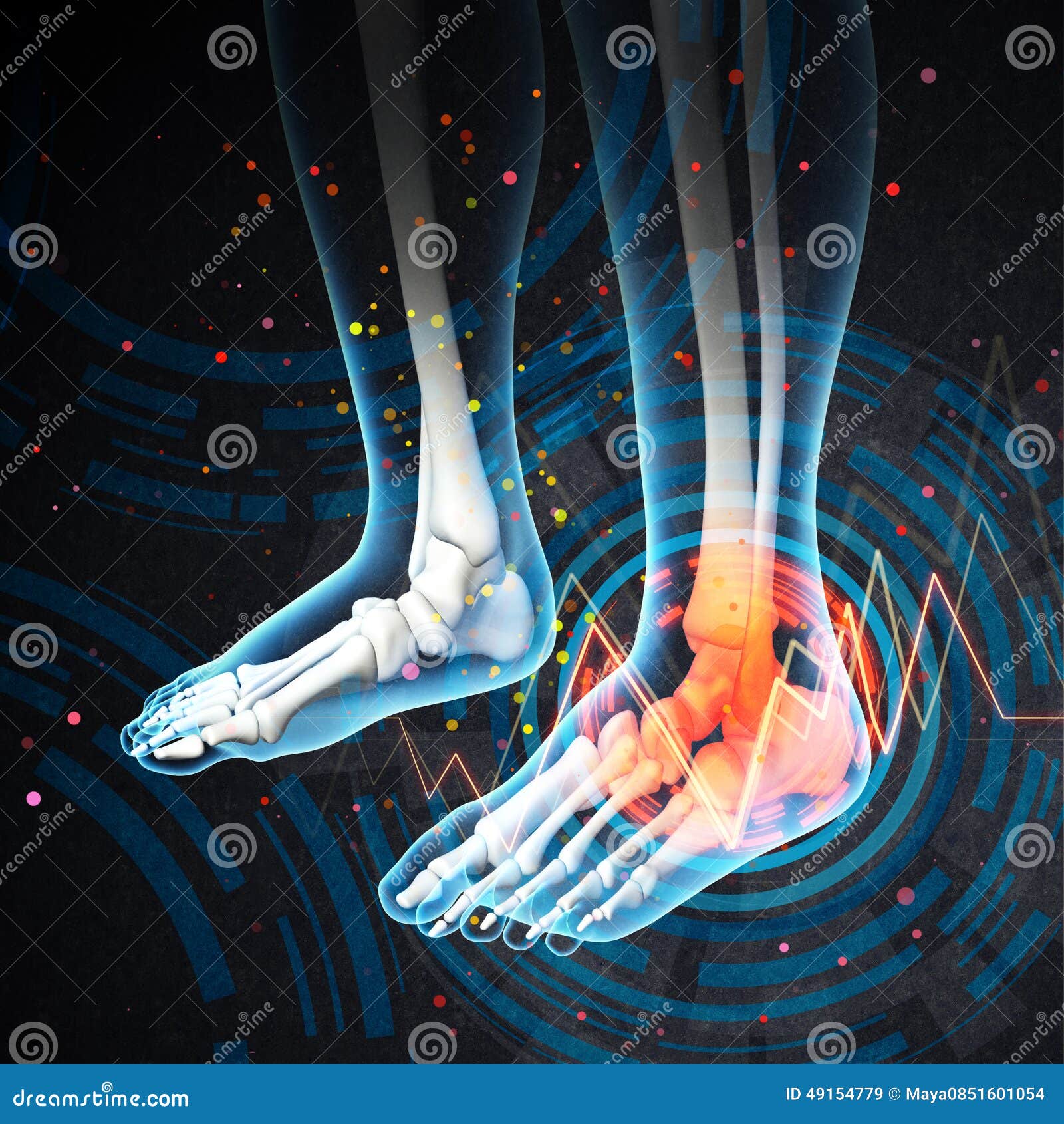 De Menselijke Pijn Van De Voet Stock Illustratie - Illustration of ...