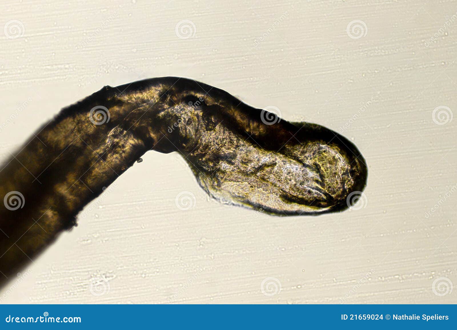 De Microscoop Van De Wortel Van Het Menselijke Haar 100x Stock Foto ...