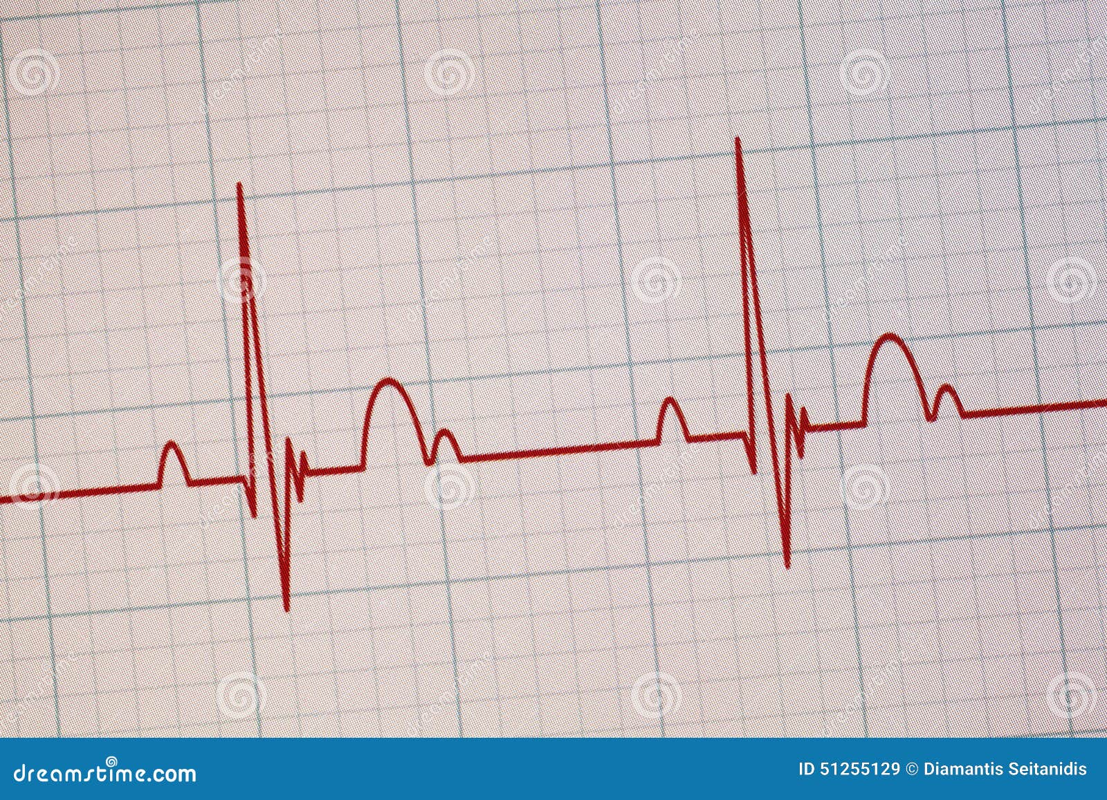 De Monitor Van ECG/van Het Electrocardiogram Stock Afbeelding - Image ...