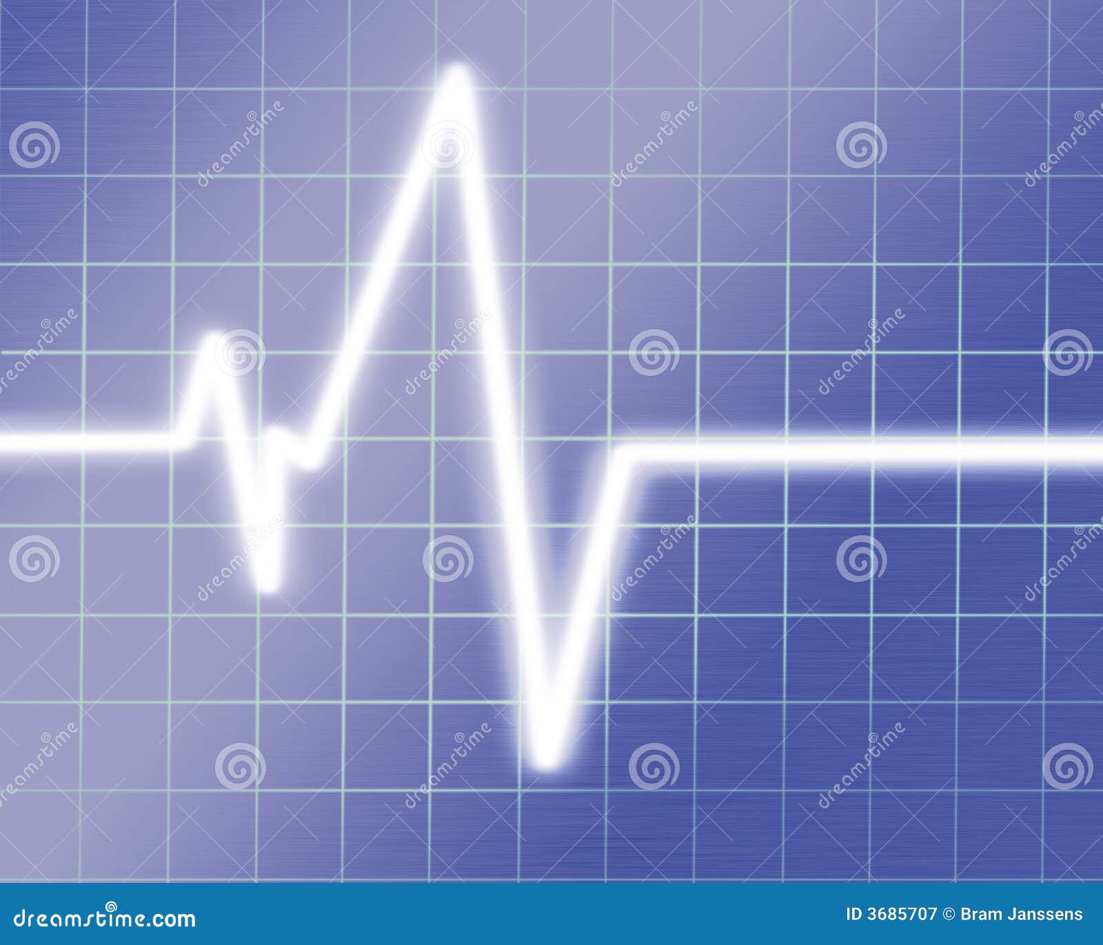 De monitor van het hart stock illustratie. Illustration of dood - 3685707