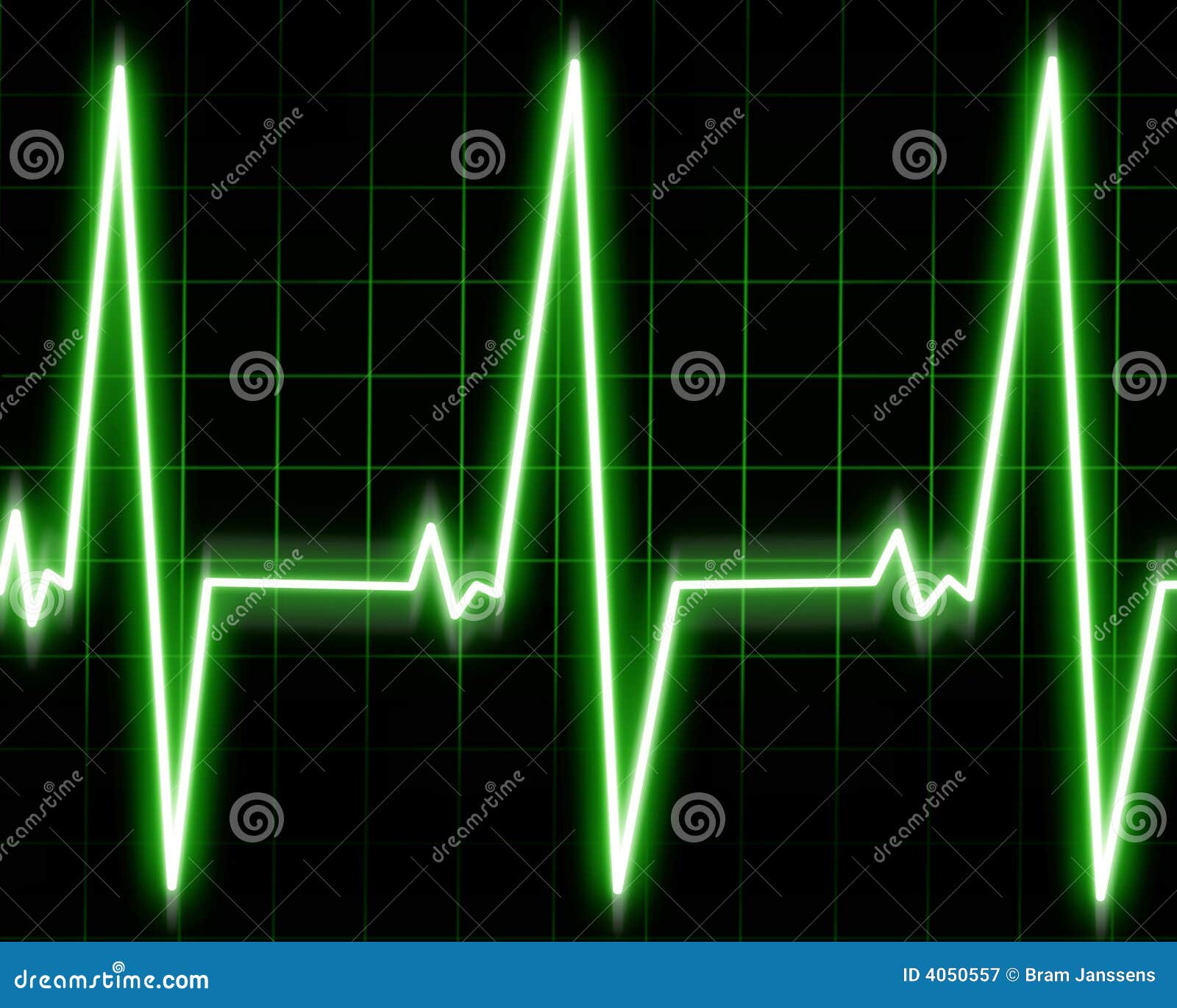 De monitor van het hart stock illustratie. Illustration of ziekenhuis ...