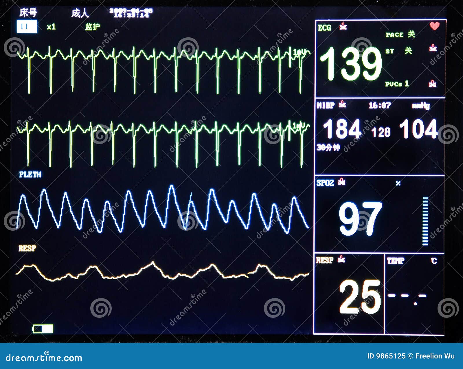 De monitor van het hart stock afbeelding. Image of adem - 9865125
