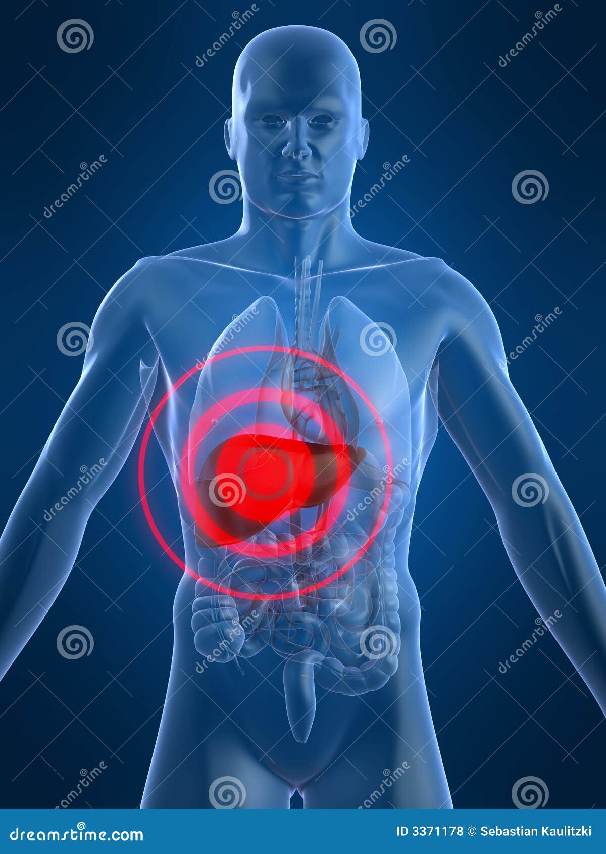 De ontsteking van de lever stock illustratie. Illustration of long ...