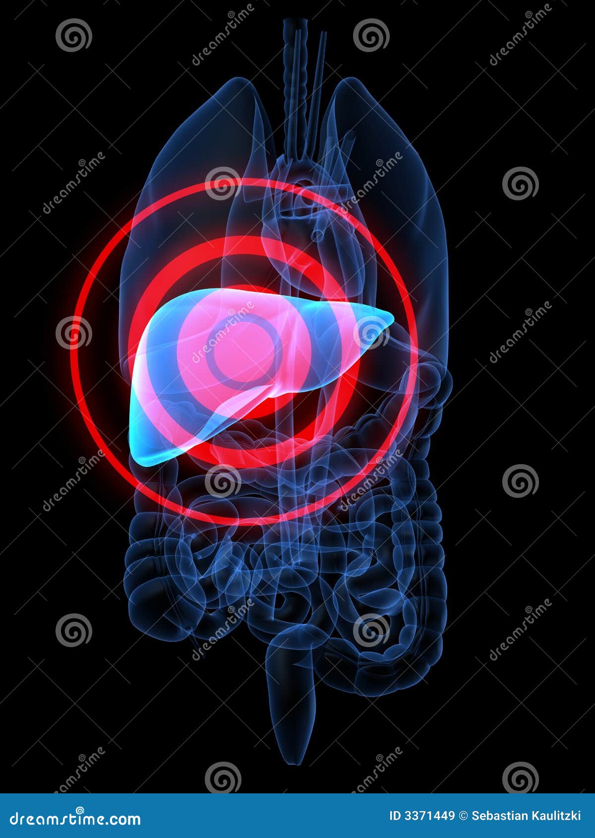 De ontsteking van de lever stock illustratie. Illustration of biologie ...