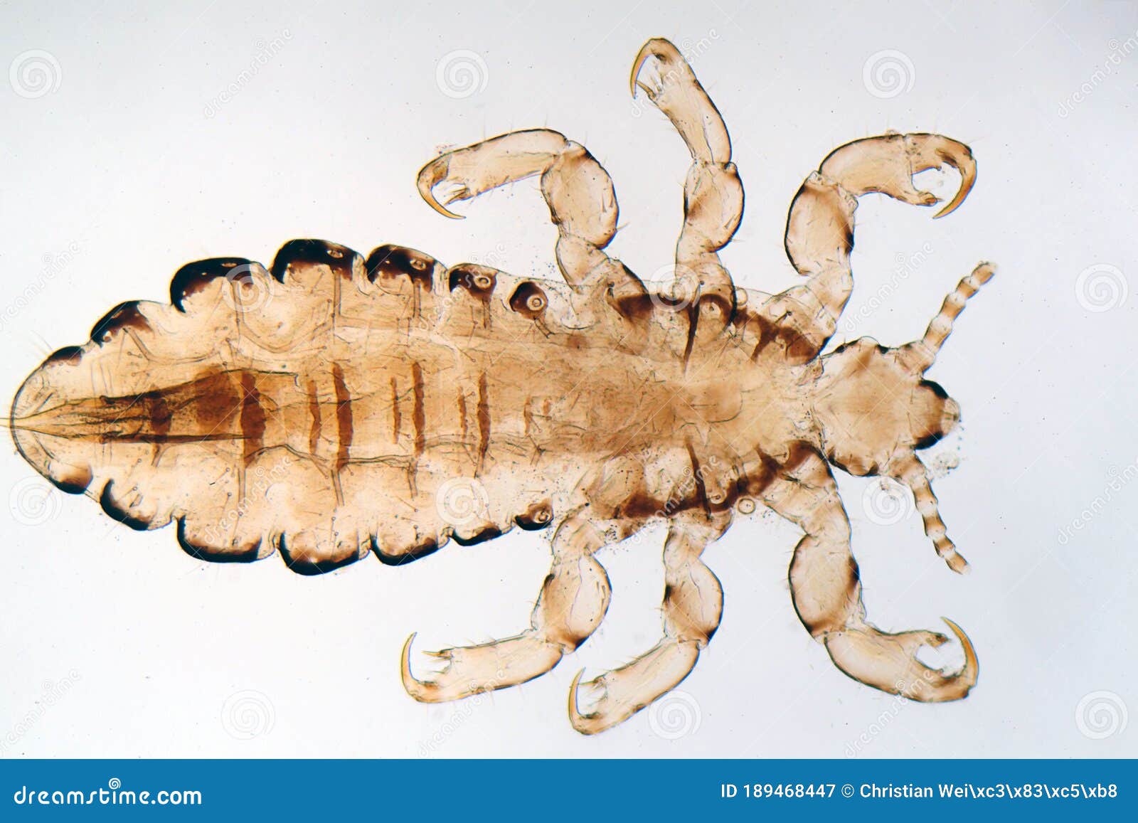 De Pediculus Humanus De Poux De Tête Sous Le Microscope Image stock ...