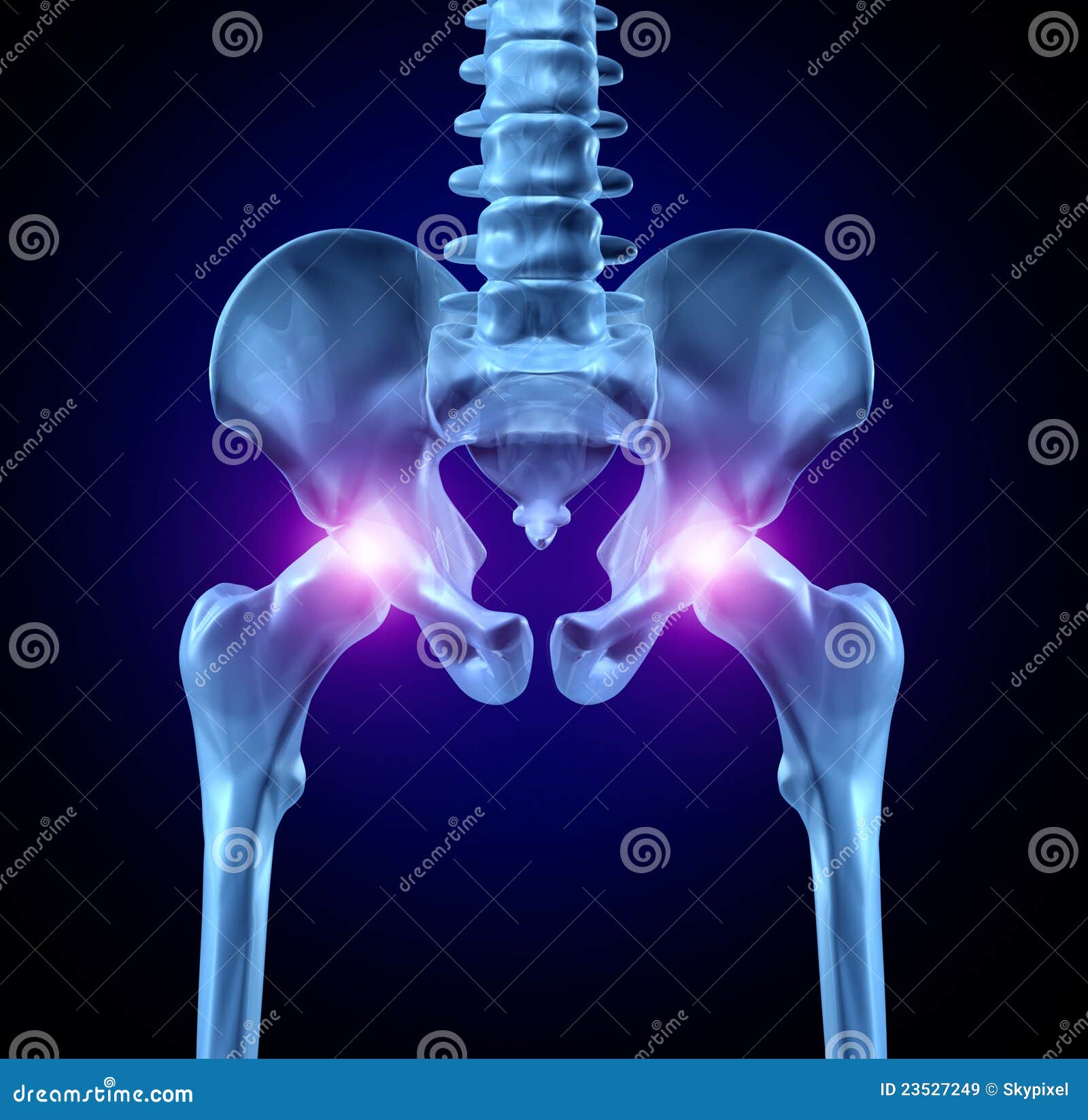De Pijn van de heup stock illustratie. Illustration of been - 23527249