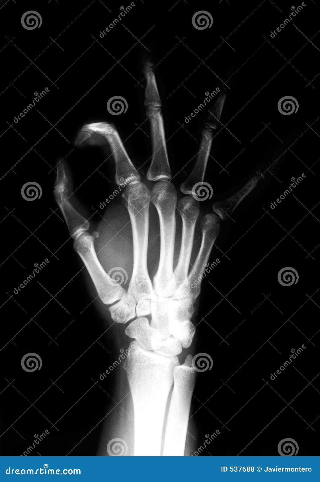 De röntgenfoto van de hand stock foto. Image of spook, radiogram - 537688