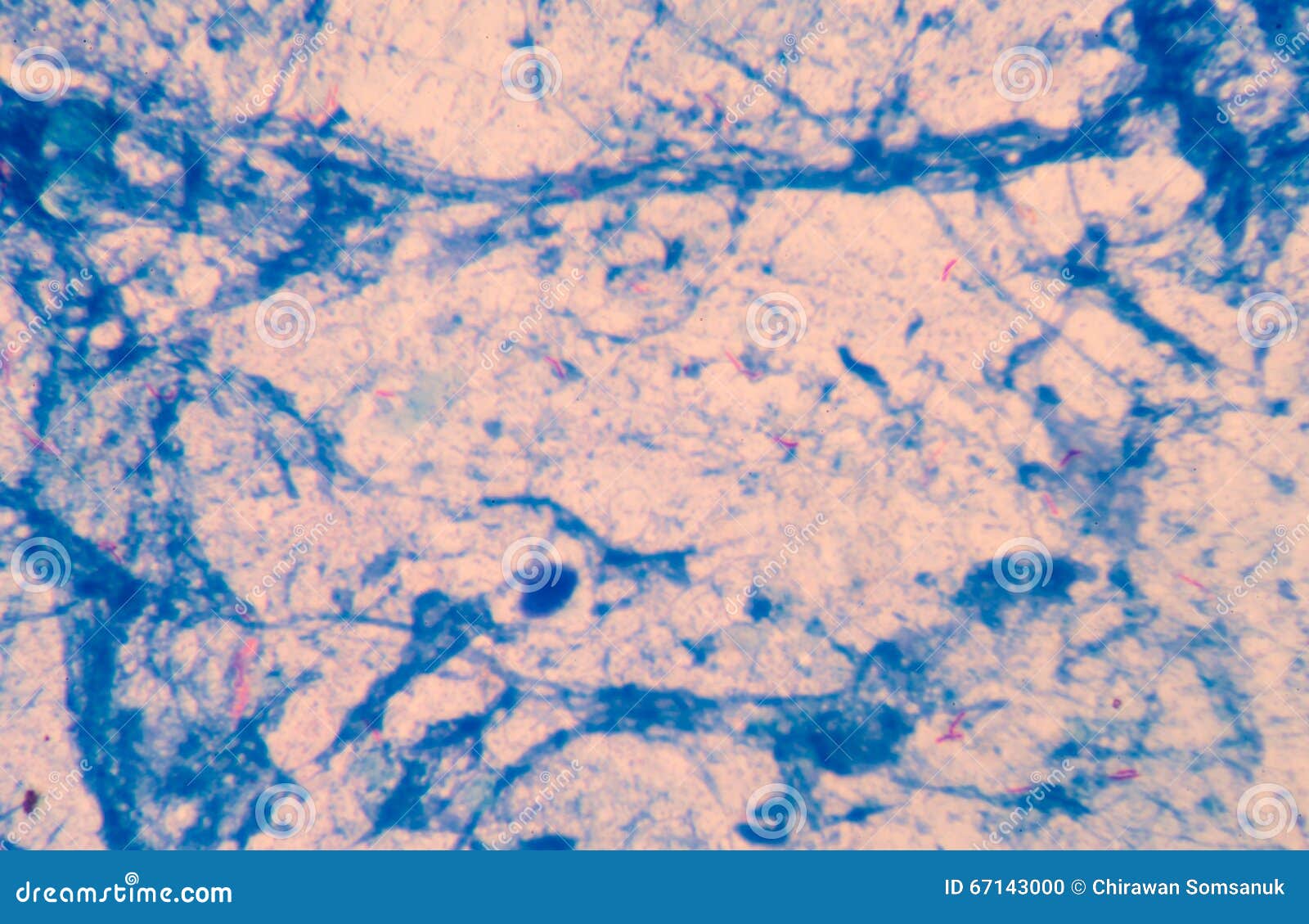 De Rode Cellen Van De Mycobacterietuberculose Stock Foto - Image of ...
