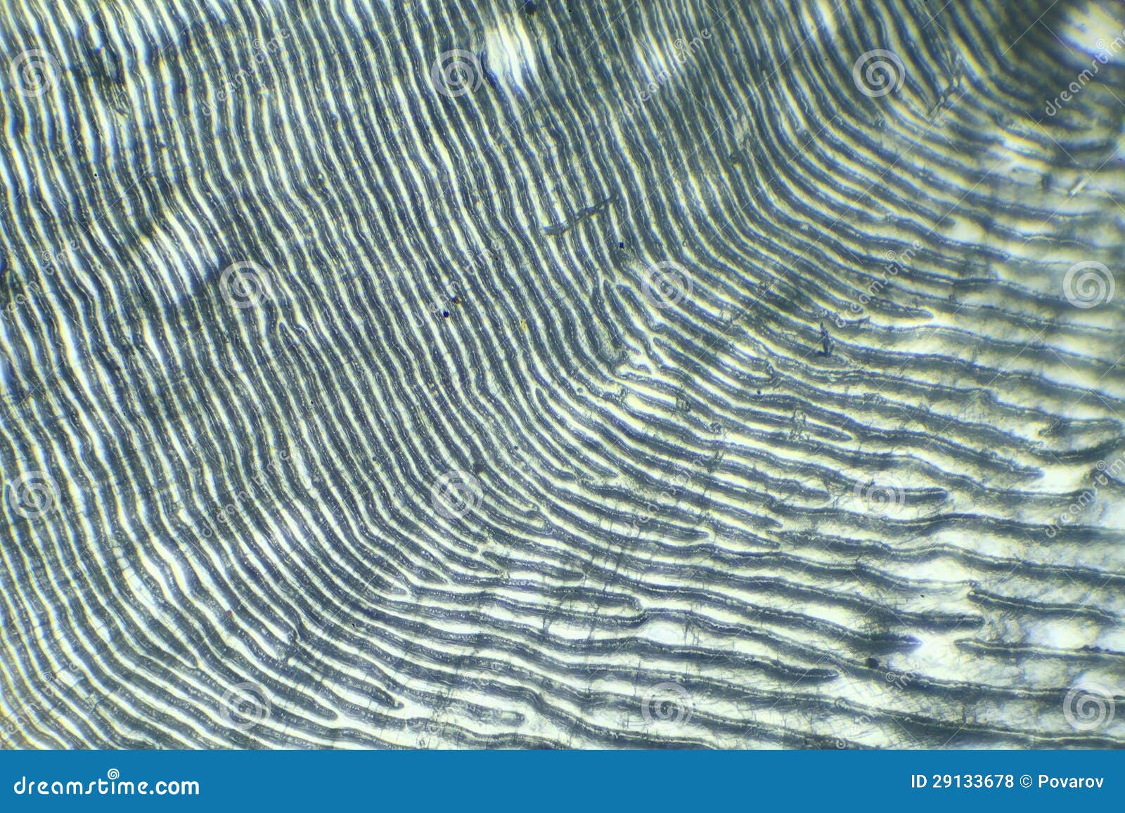 De Schalen Van Vissen Onder De Microscoop Stock Foto - Image of forel ...