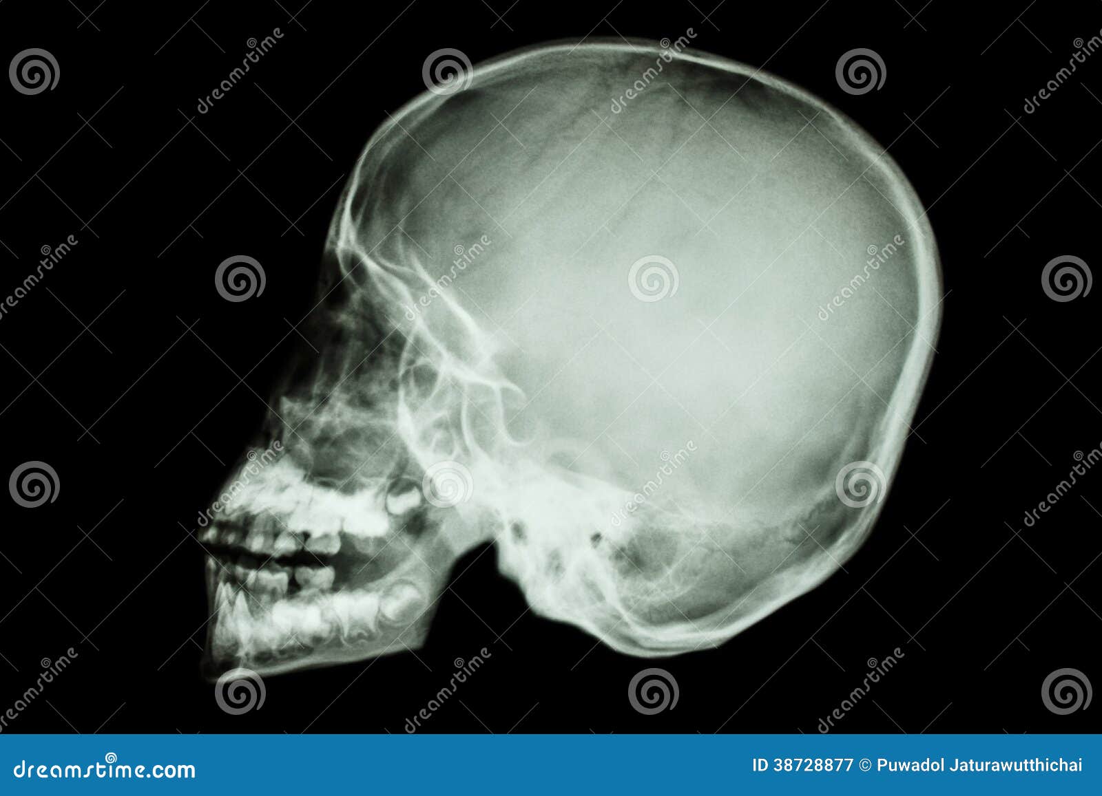 De Schedel Van Het Aziatische Kind (Thaise Mensen) Stock Afbeelding ...