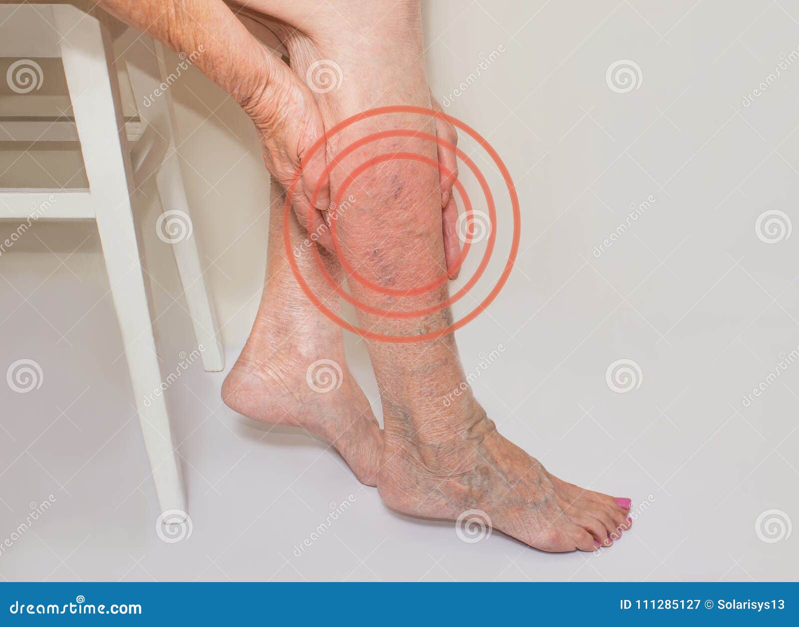 De Spataders Op Benen Van Oude Vrouw Op Grijs Stock Afbeelding - Image ...