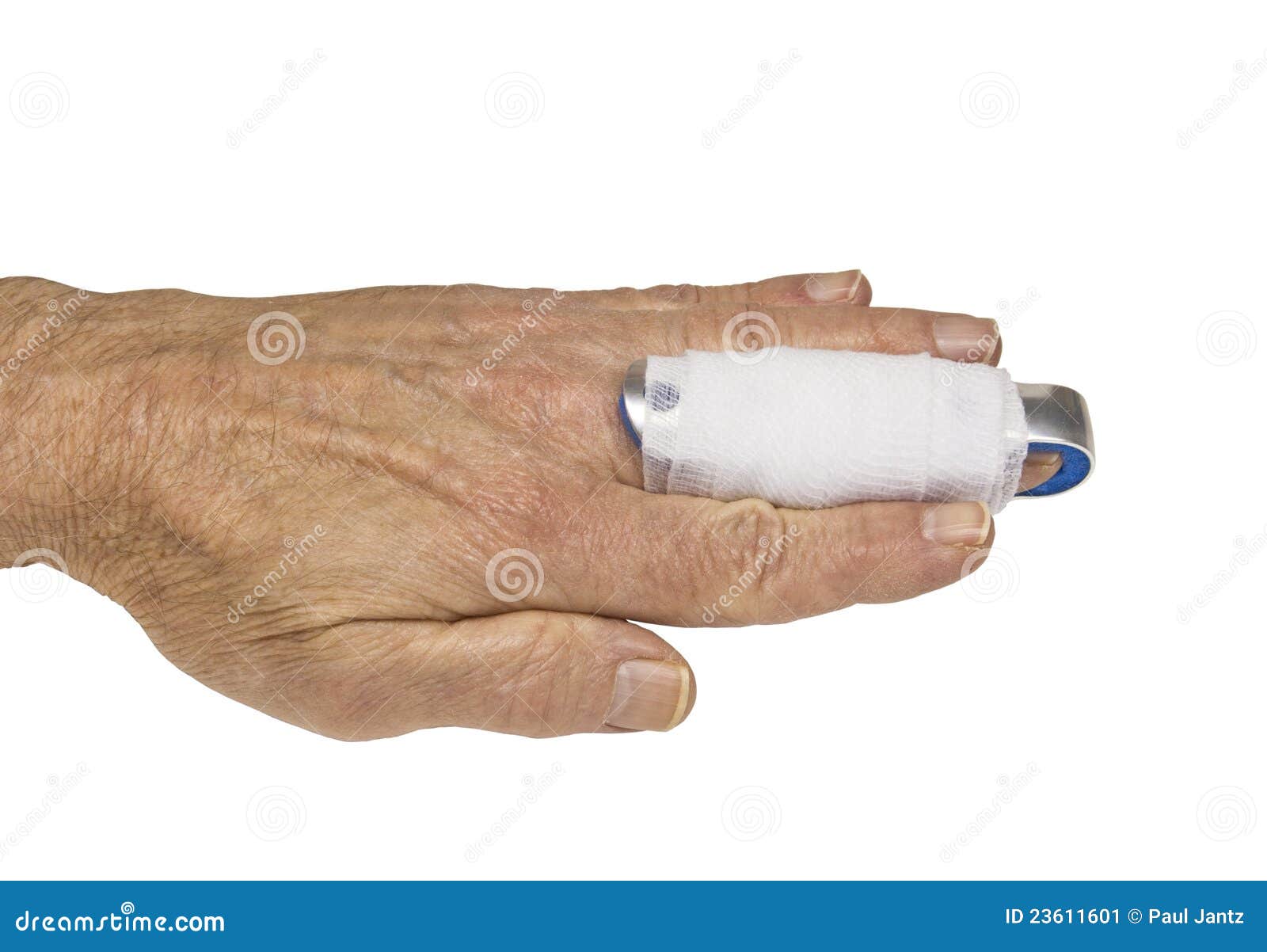 De splinter van de vinger stock afbeelding. Image of verwonding - 23611601