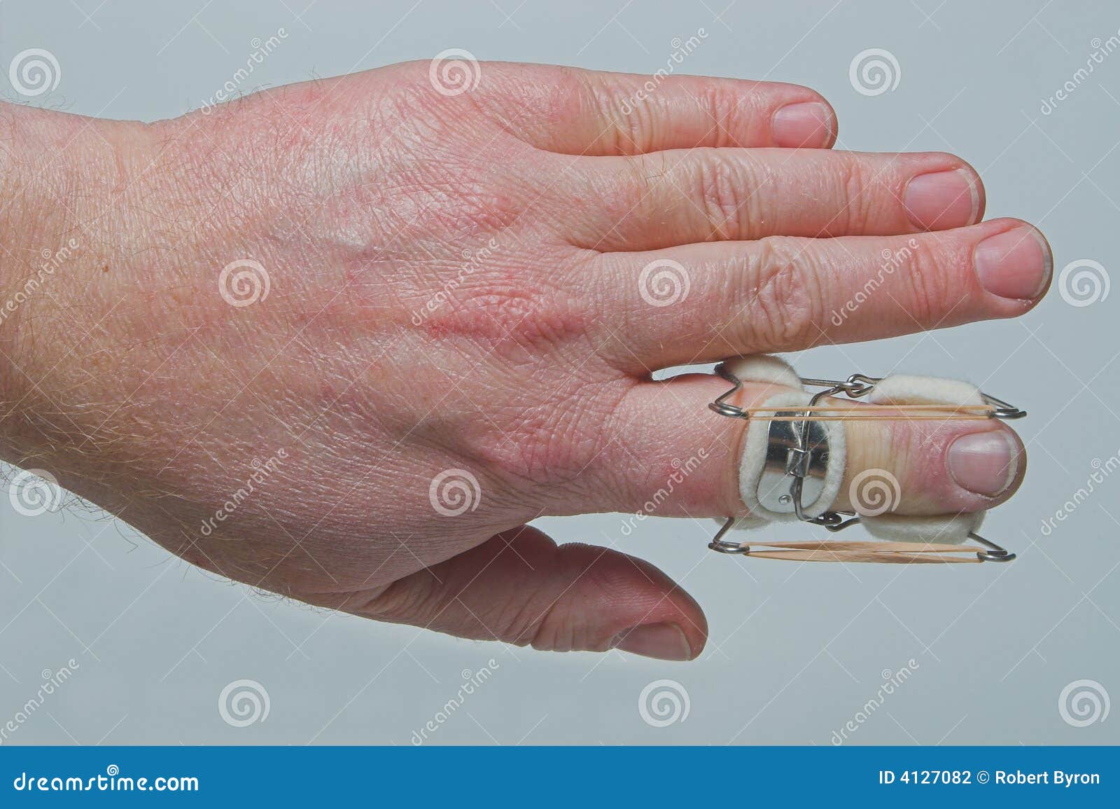 De Steun van de vinger stock foto. Image of onderbreking - 4127082