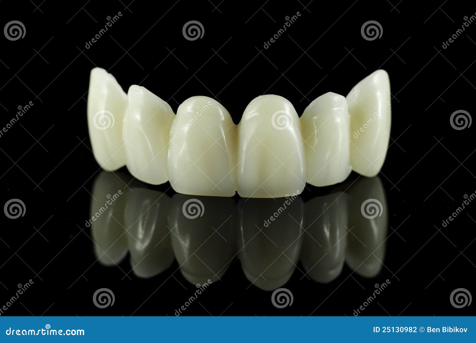 De tand Brug van de Tand stock foto. Image of tandarts - 25130982