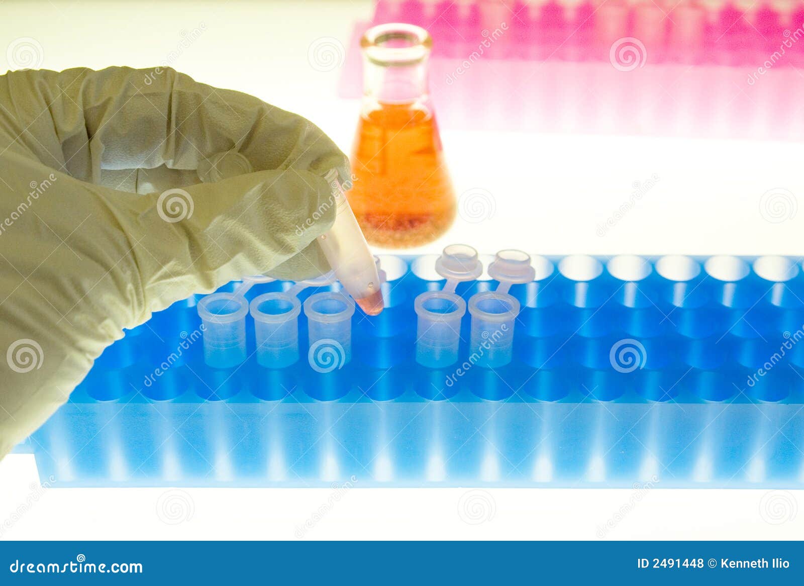 De Voorbereiding Van De Steekproef Stock Foto - Image of steekproef ...