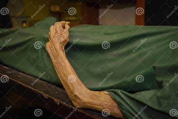 The Dead Body. Focus on Hand Decay Stock Photo - Image of person ...