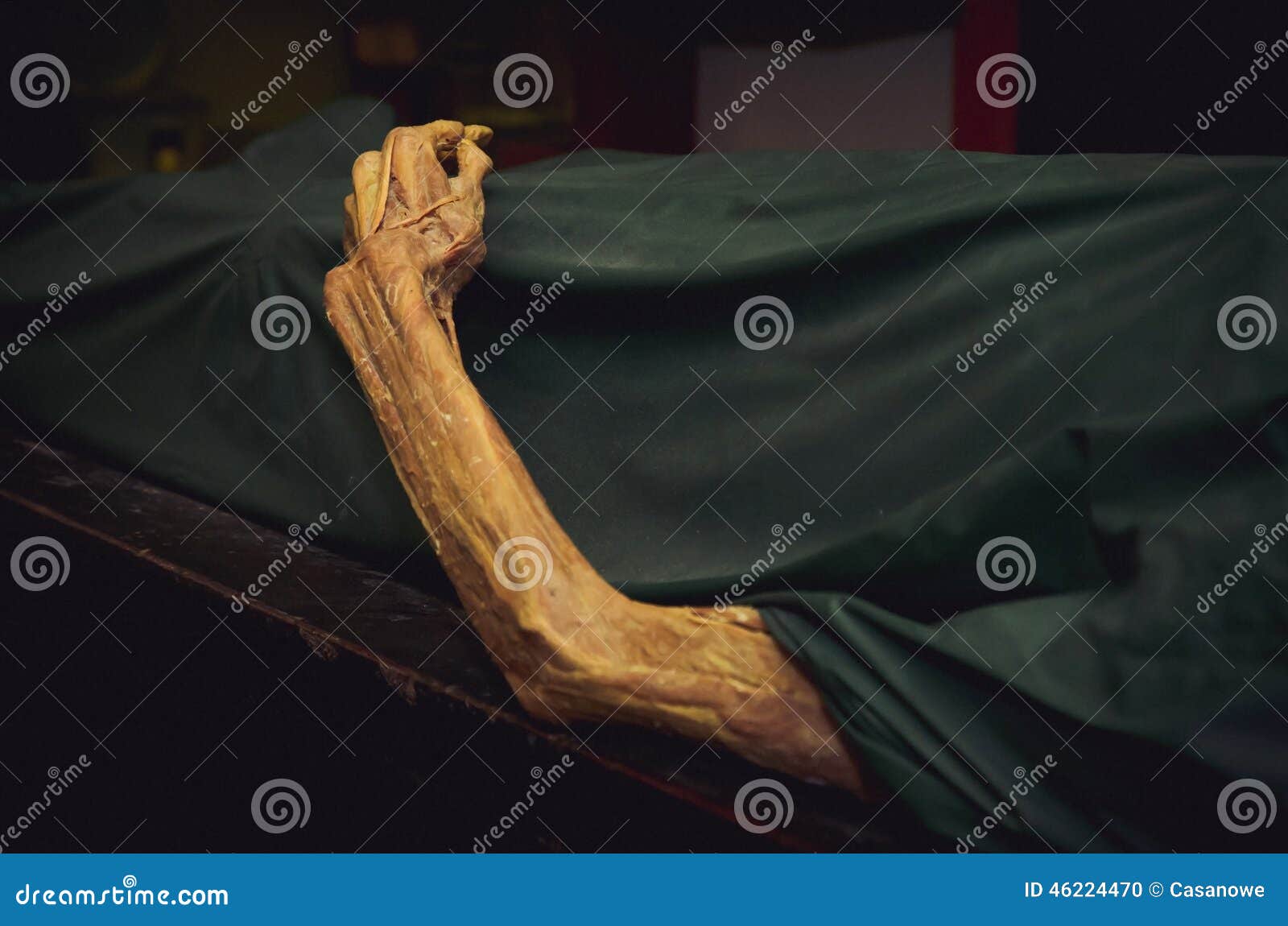 The Dead Body. Focus on Hand Decay Stock Photo - Image of people ...