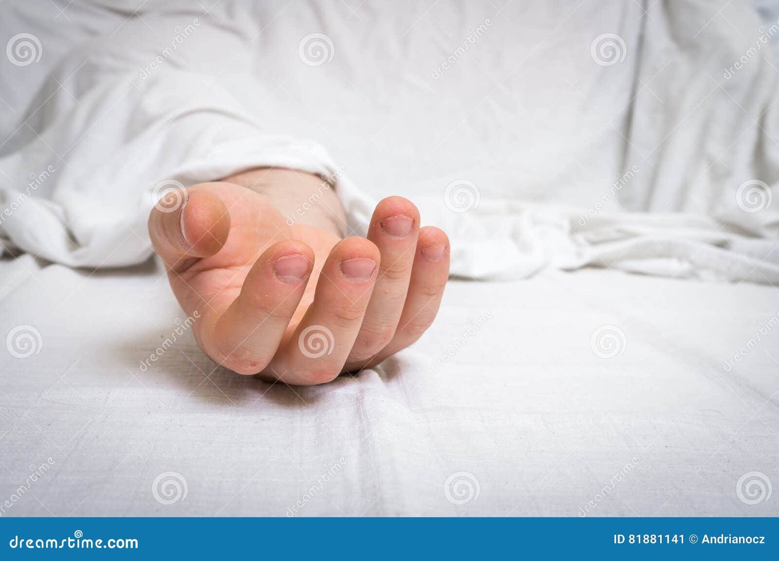 The Dead Man`s Body Under White Cloth with Focus on Hand Stock Image ...