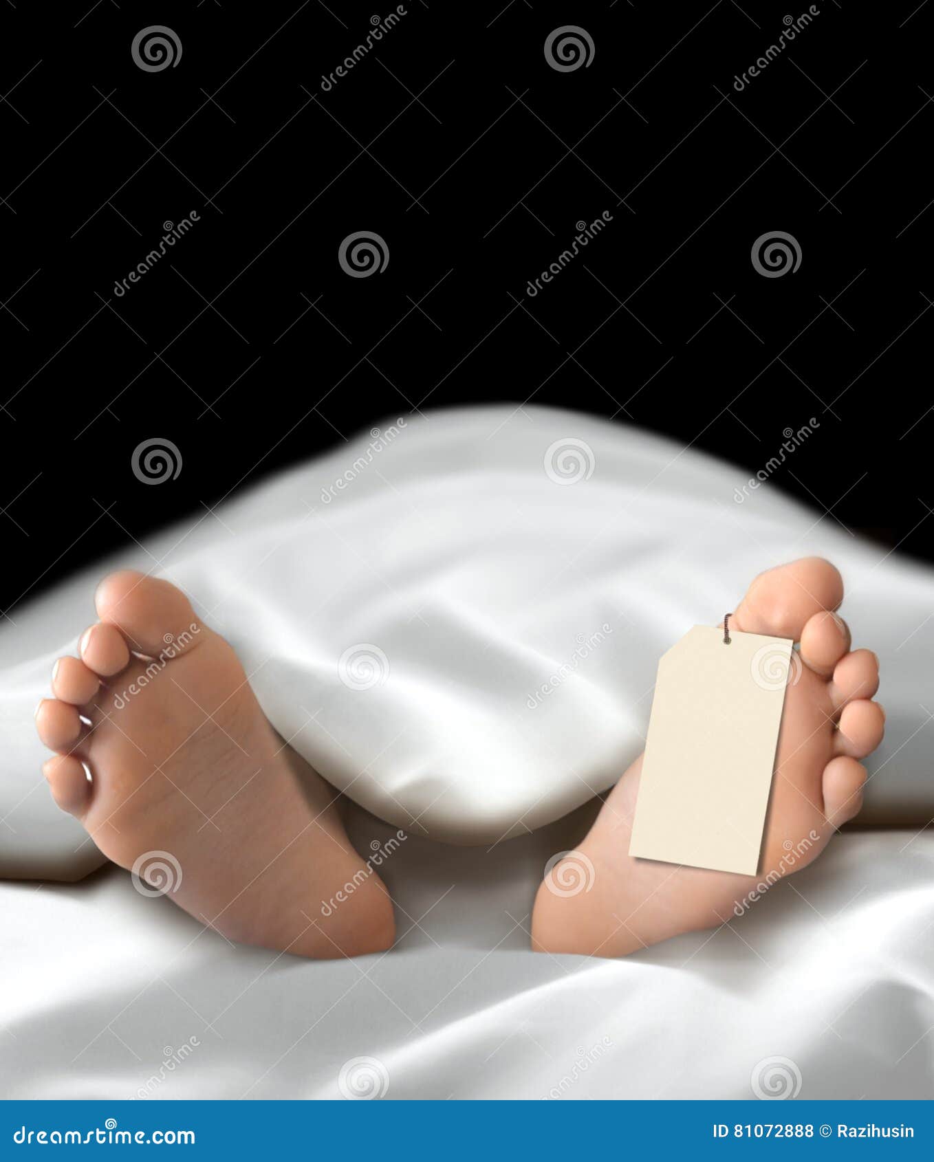 Dead Person Body Lying in the Morgue Stock Photo - Image of victim ...