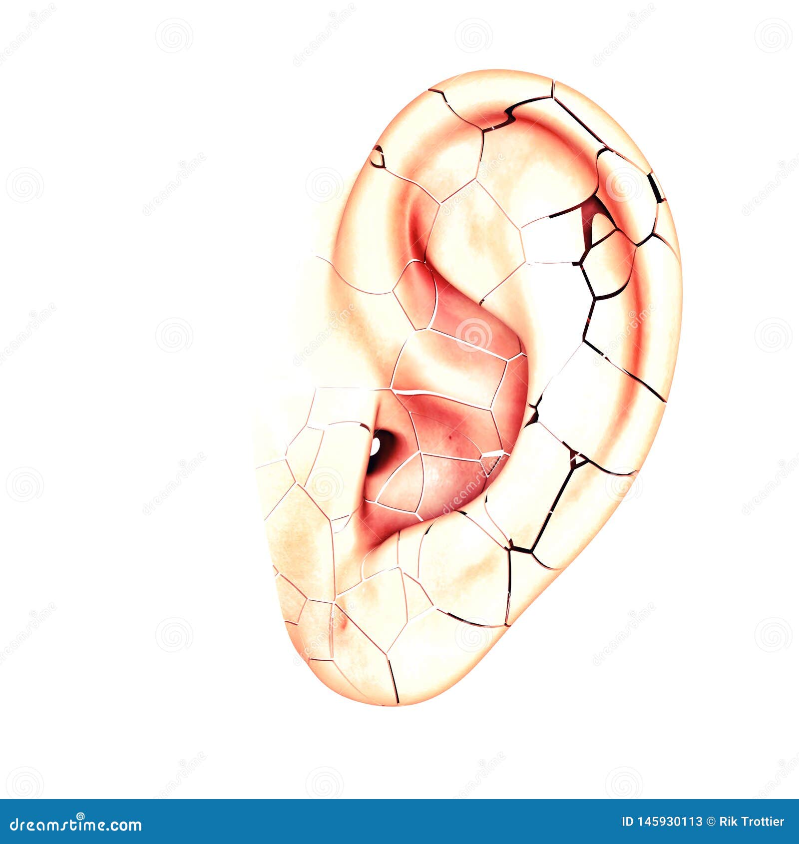 Ear Broken Isolated on White Stock Illustration - Illustration of cracked, hard: 145930113