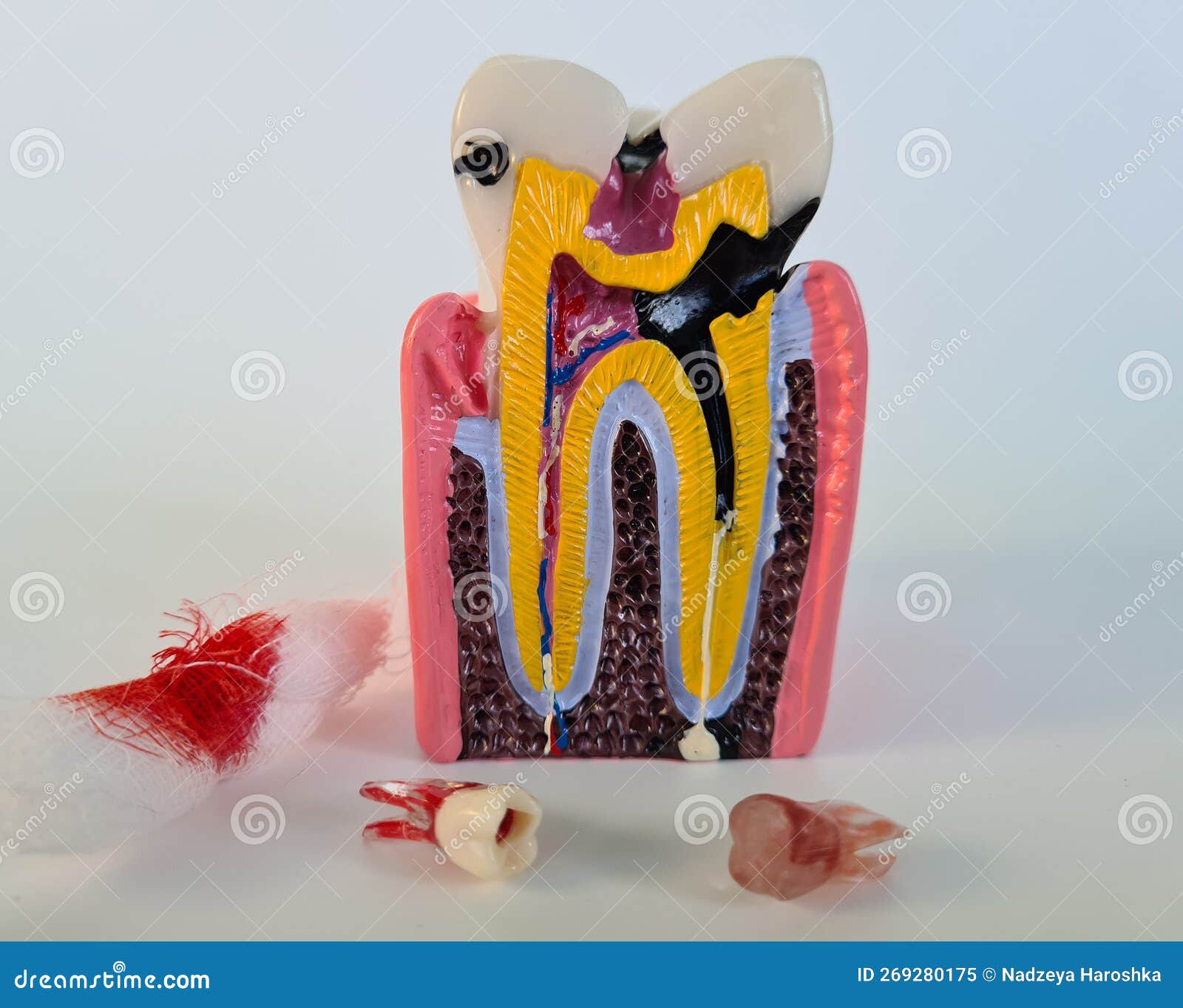 Extraction Of Decayed Tooth On White Background. Royalty-Free Stock ...