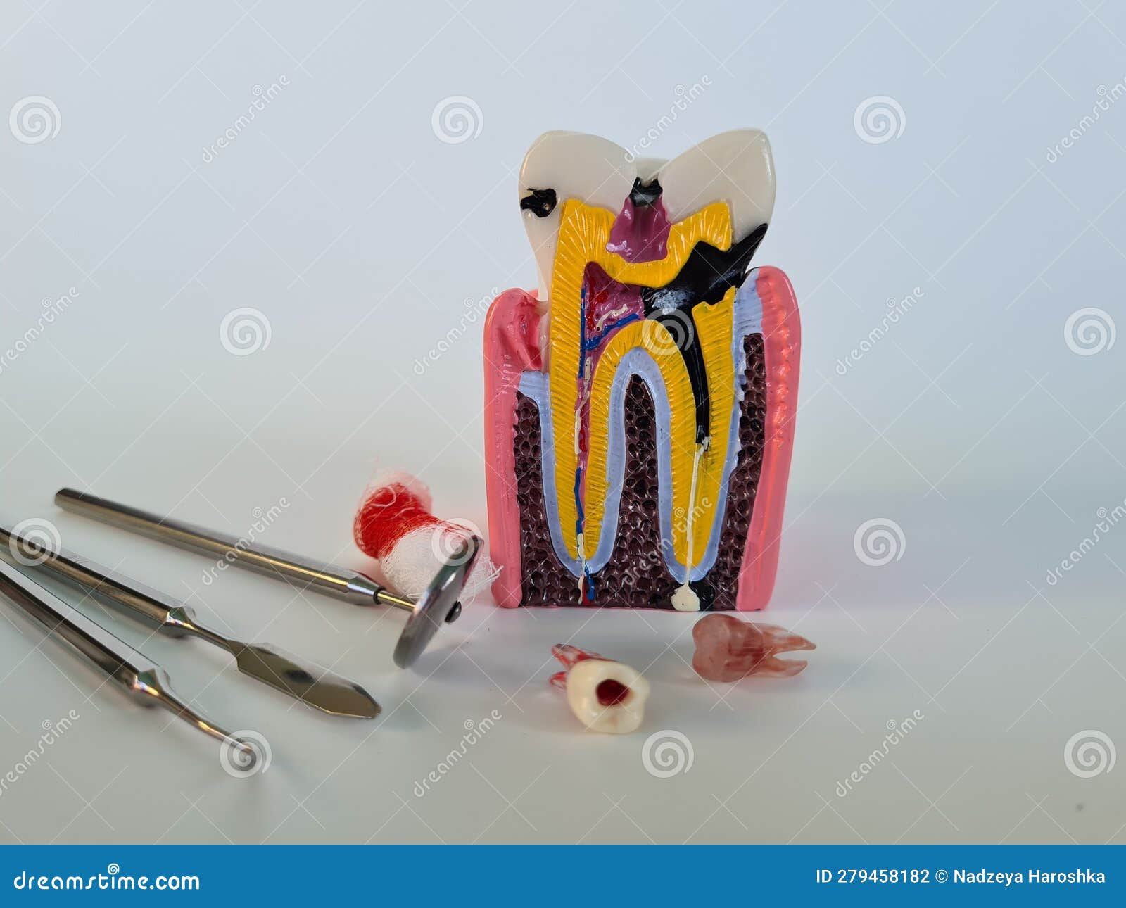 Decayed Root Tooth is Removed. Caries and Tooth Extraction and Dental ...