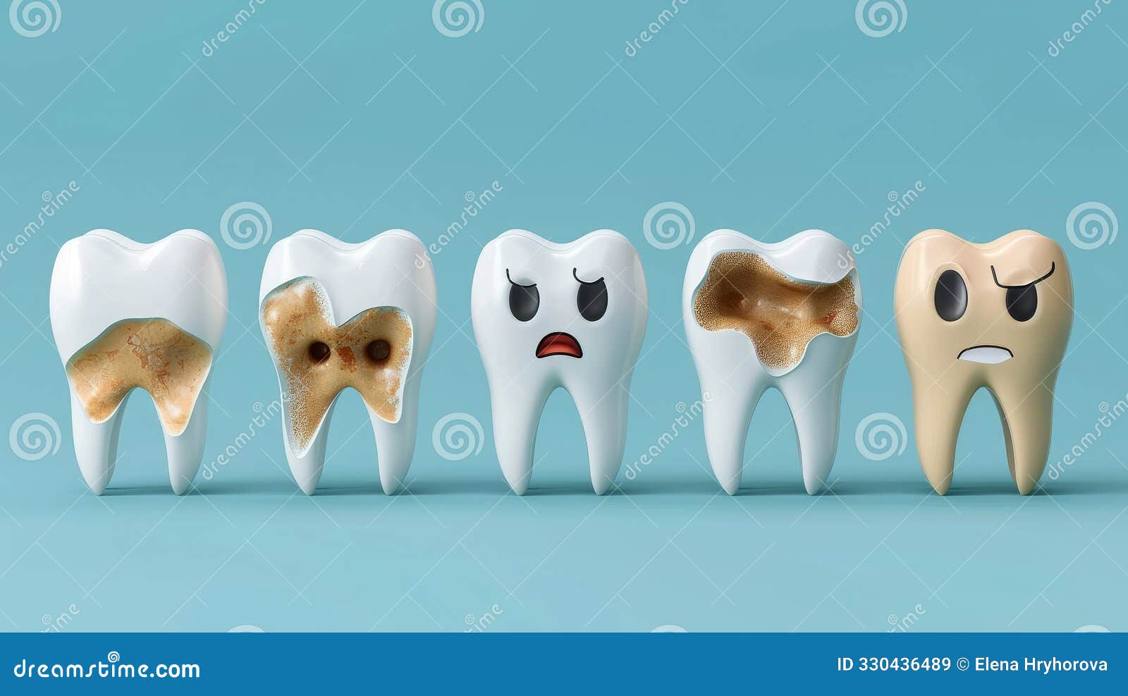 Decayed Teeth with Skull Shapes Depicting the Stages of Tooth Decay and ...