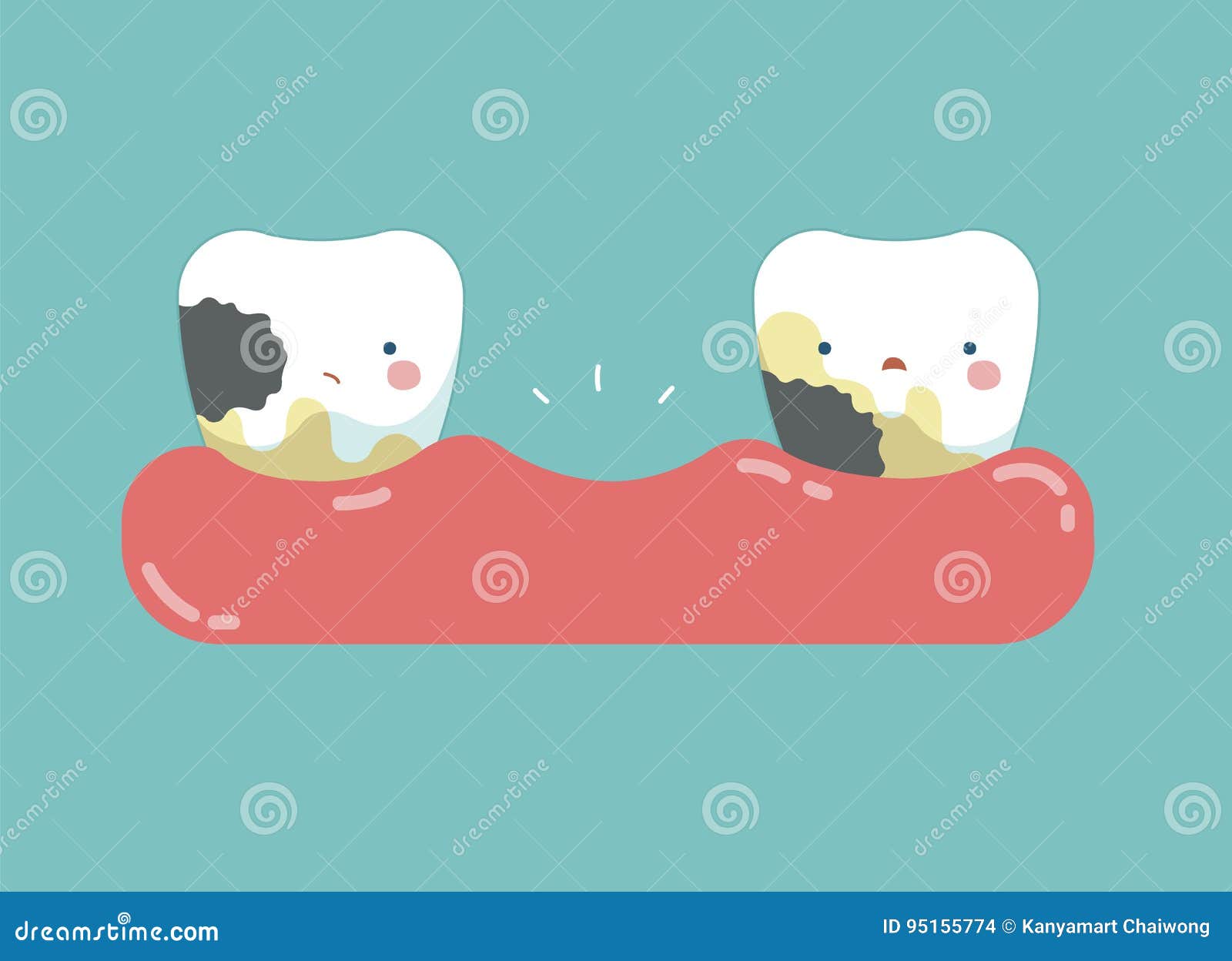 Decayed Teeth ,teeth and Tooth Concept of Dental Stock Vector ...