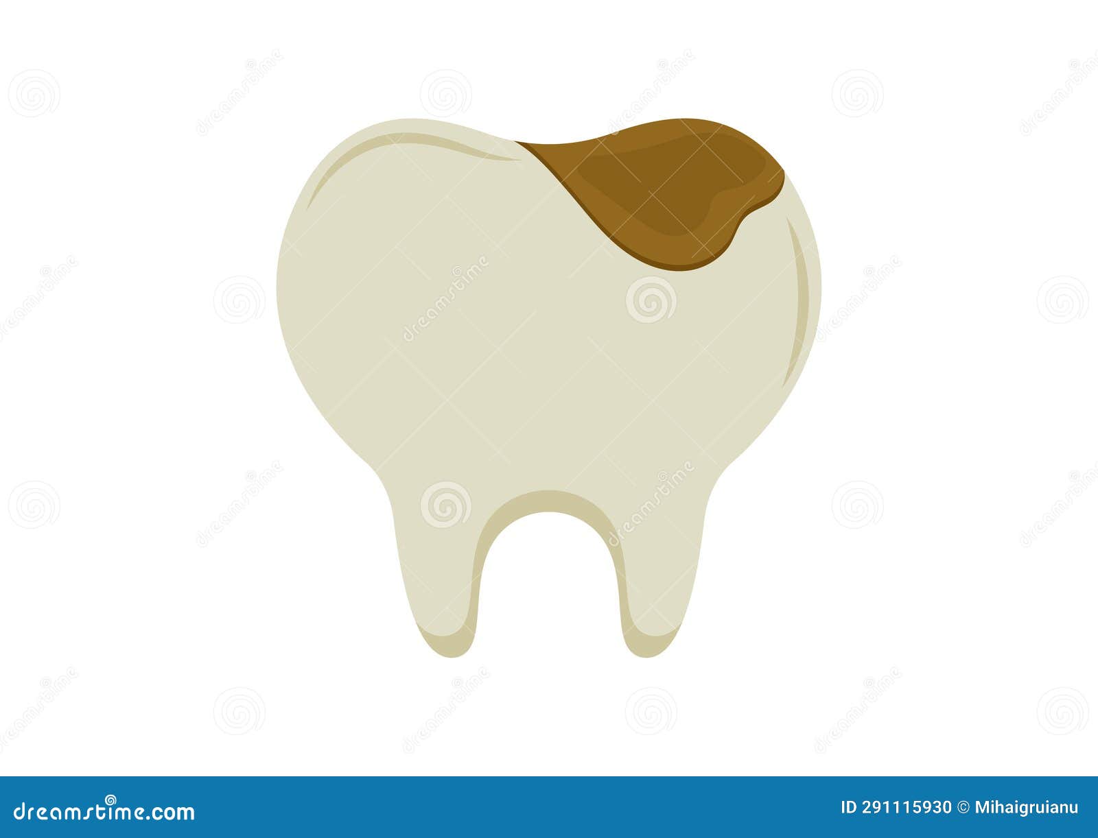 Decayed Tooth Vector Illustration Stock Vector - Illustration of ...