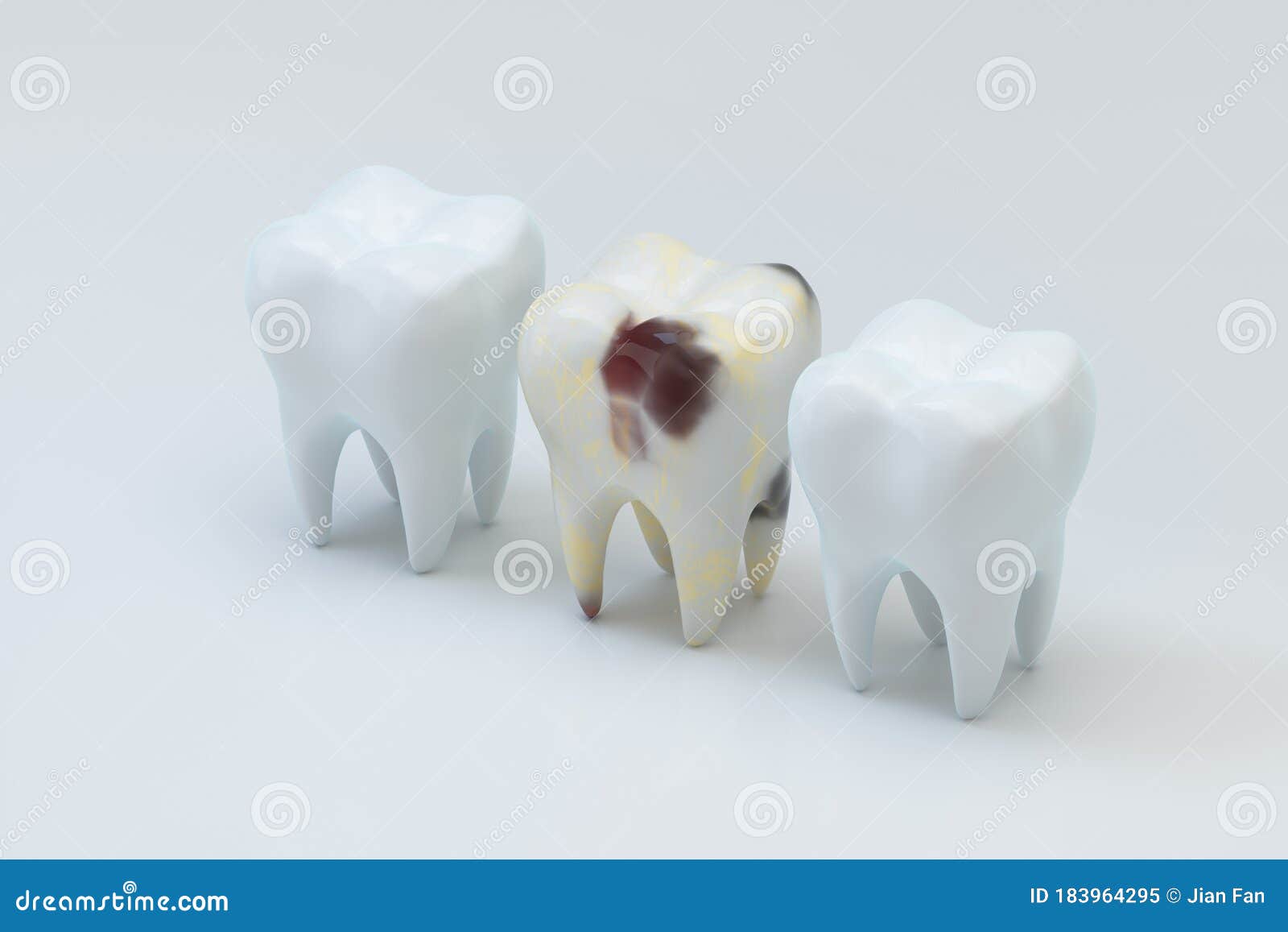 The Decayed Tooth beside with the White Tooth, 3d Rendering Stock ...