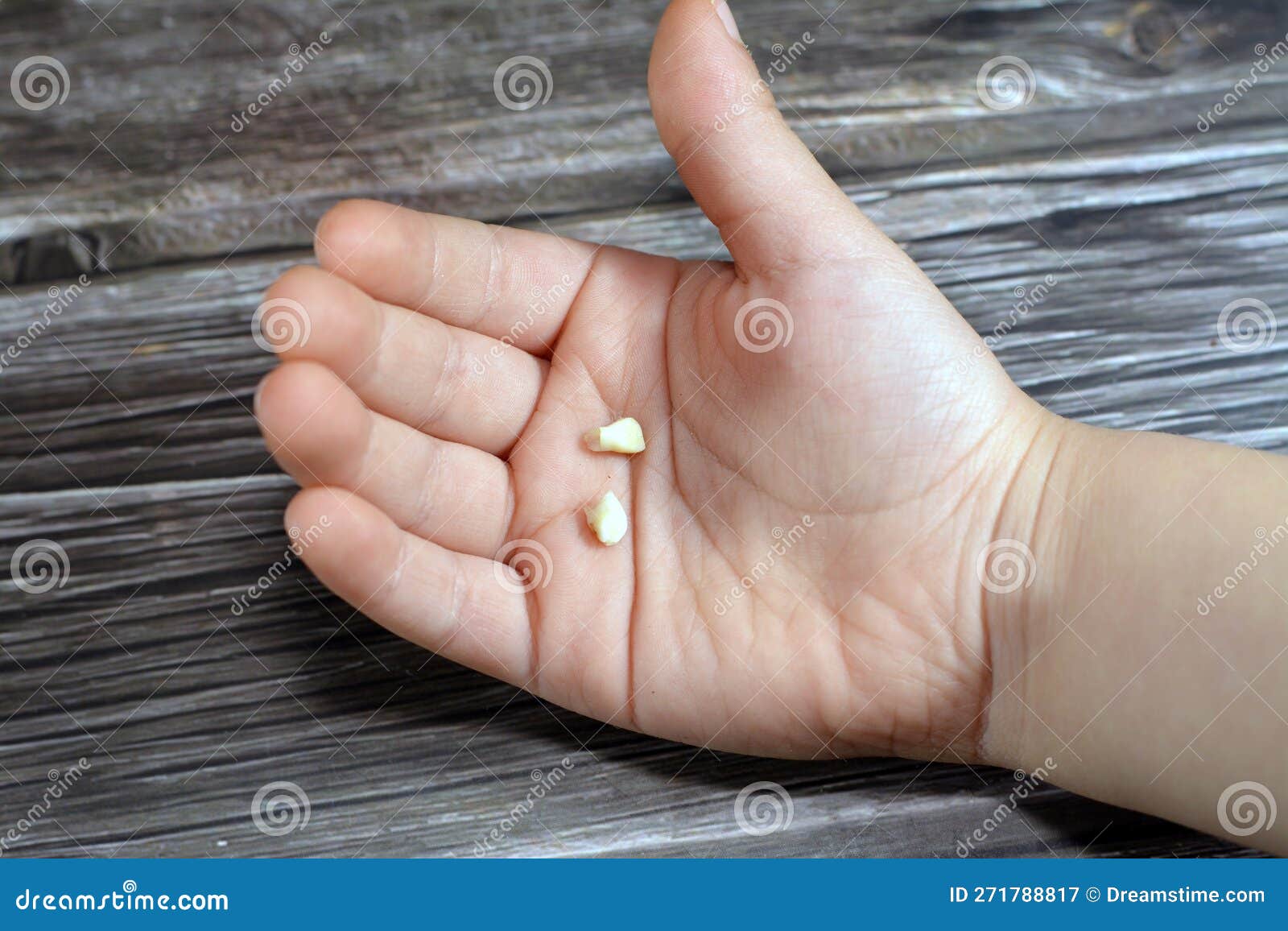 Deciduous Primary Baby Temporary Teeth, the First Set of Teeth in the ...