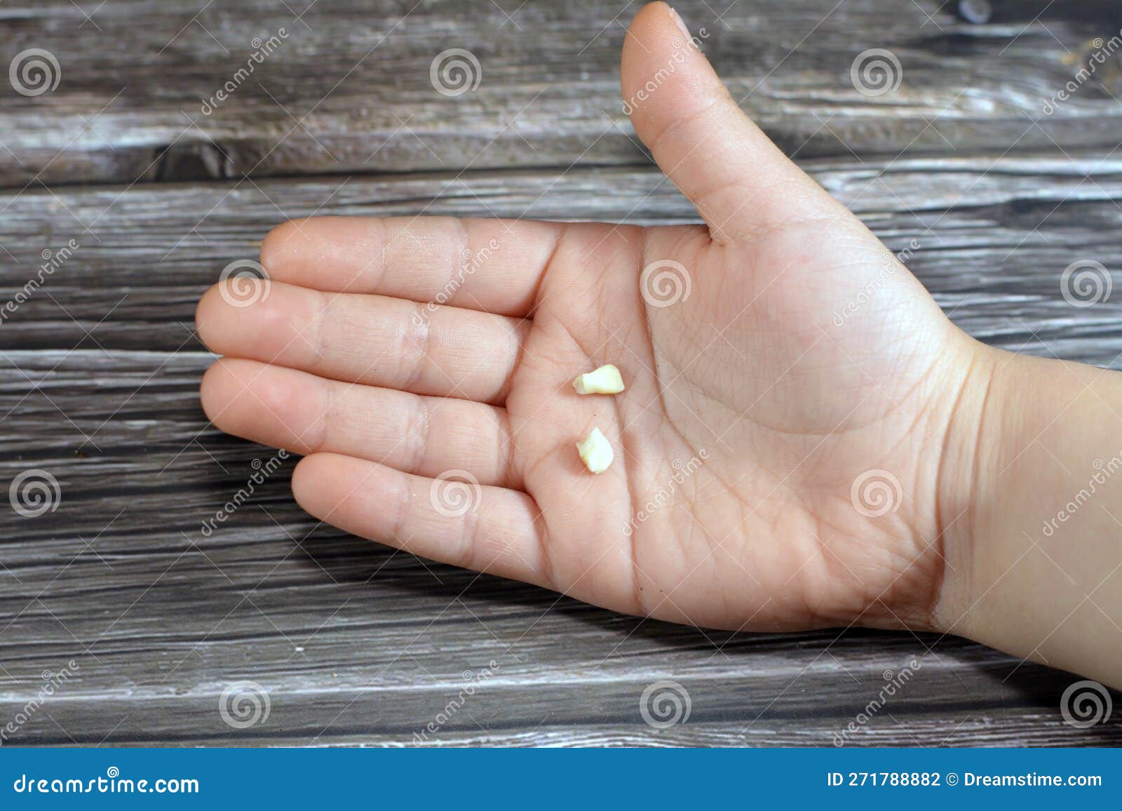 Deciduous Primary Baby Temporary Teeth, the First Set of Teeth in the ...