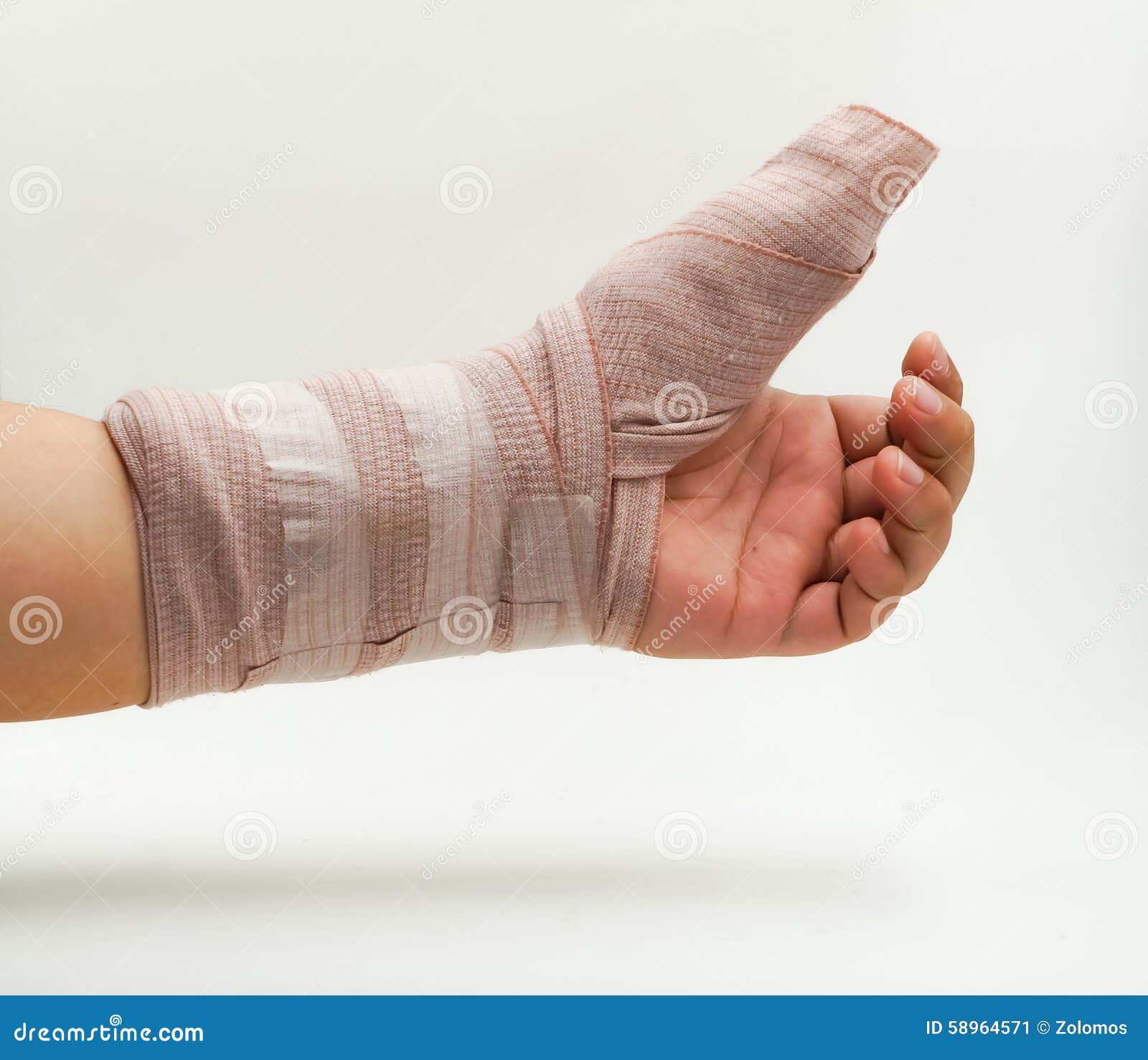 Dedo Da Tala Um Osso Quebrado Imagem de Stock - Imagem de hospital ...