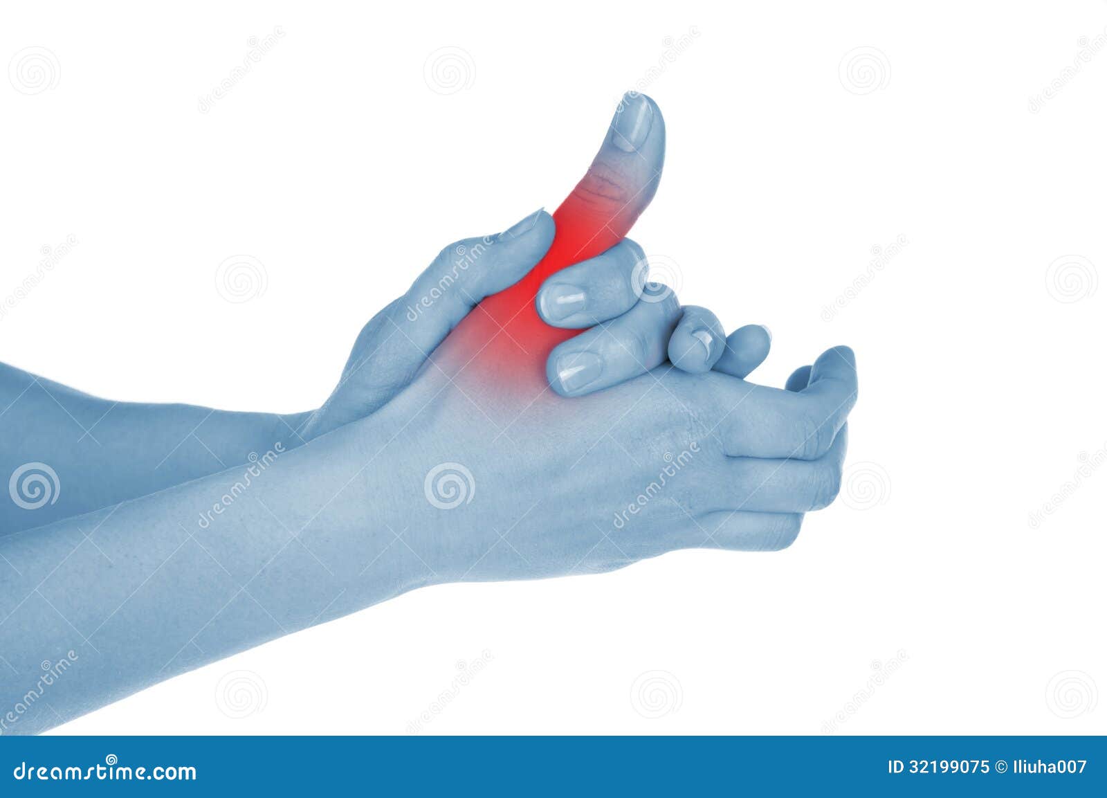 Dedo Gordo Dolorido, Mostrado Rojo Imagen de archivo - Imagen de ...