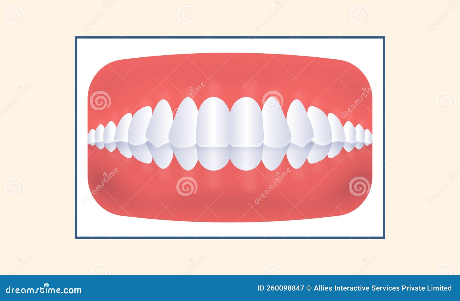 Bite Teeth, Occlusion Chewing Tooth, Dental Malocclusion Problem ...