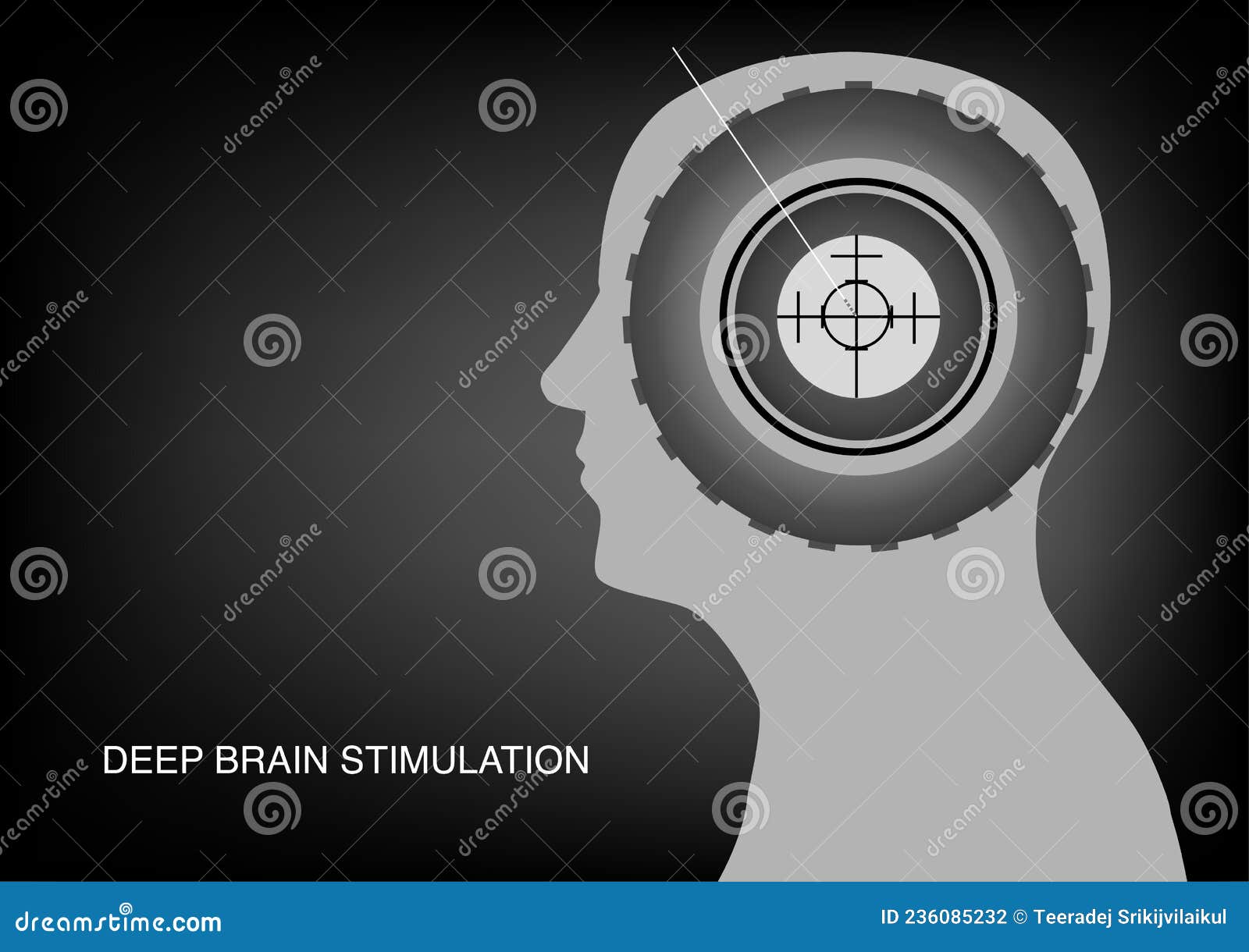 Brain Stimulation Helmet Isolated. Apparatus Electronic Action On Brain ...