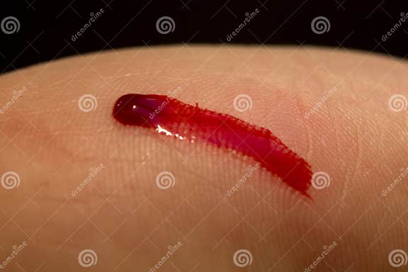 Deep Cut Caused by Knife in Hand Palm Stock Photo - Image of ...
