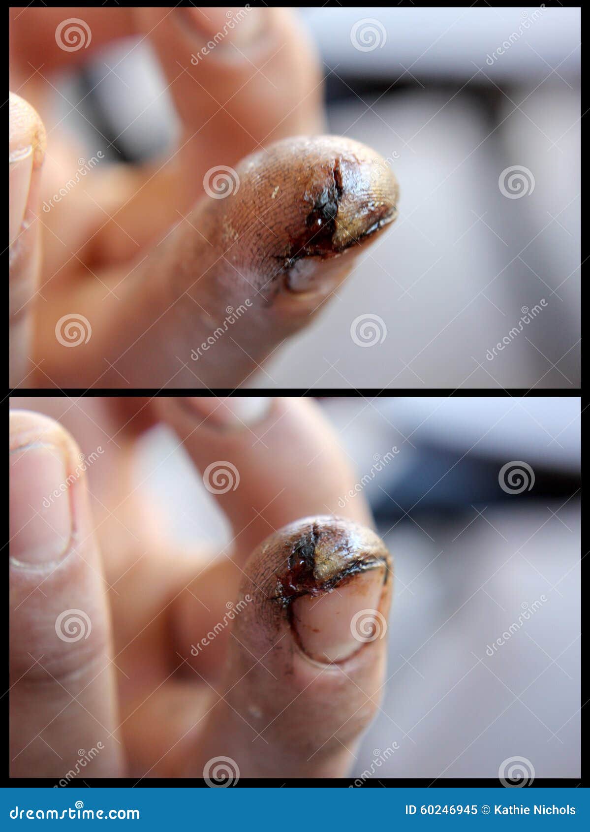 Deep Cut Finger