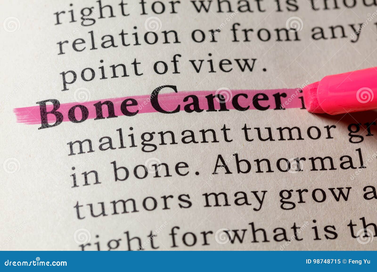 Definition of Bone Cancer stock image. Image of highlighter - 98748715