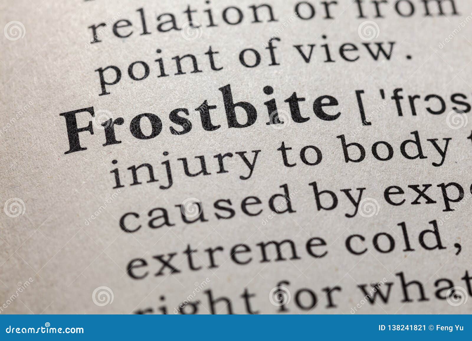 Definition of frostbite stock image. Image of concept - 138241821