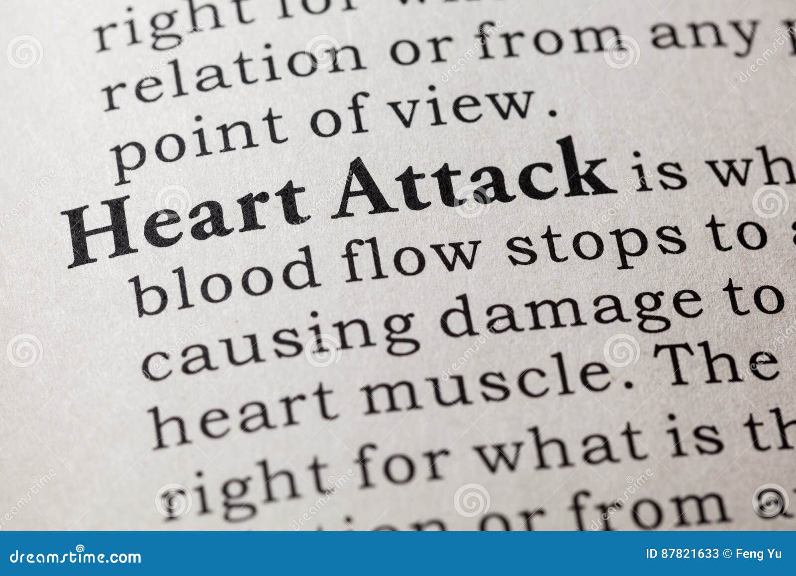 Definition of heart attack stock image. Image of printing - 87821633